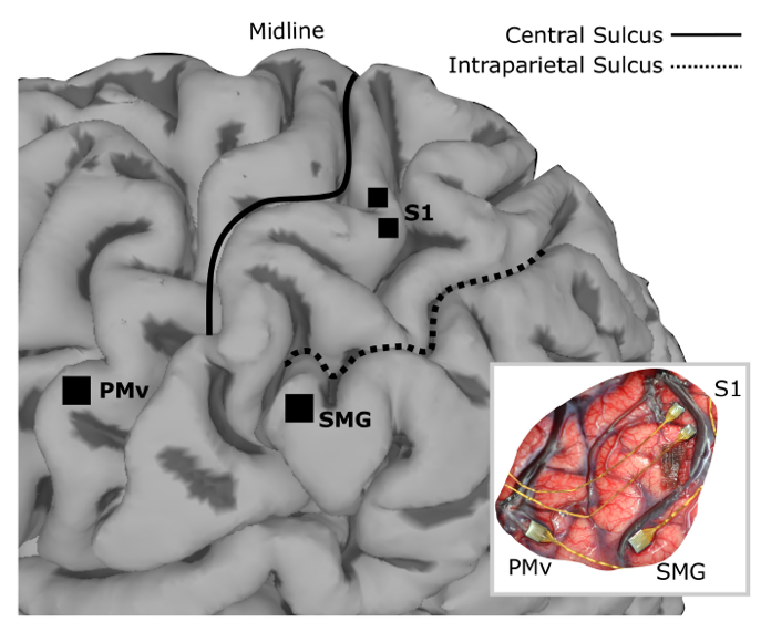 神经科学的最新研究应用：加州理工首次利用Blackrock microsystems的微电极刺激大脑产生自然感觉-科圣科技-Blackrock Microsystems, ASIA