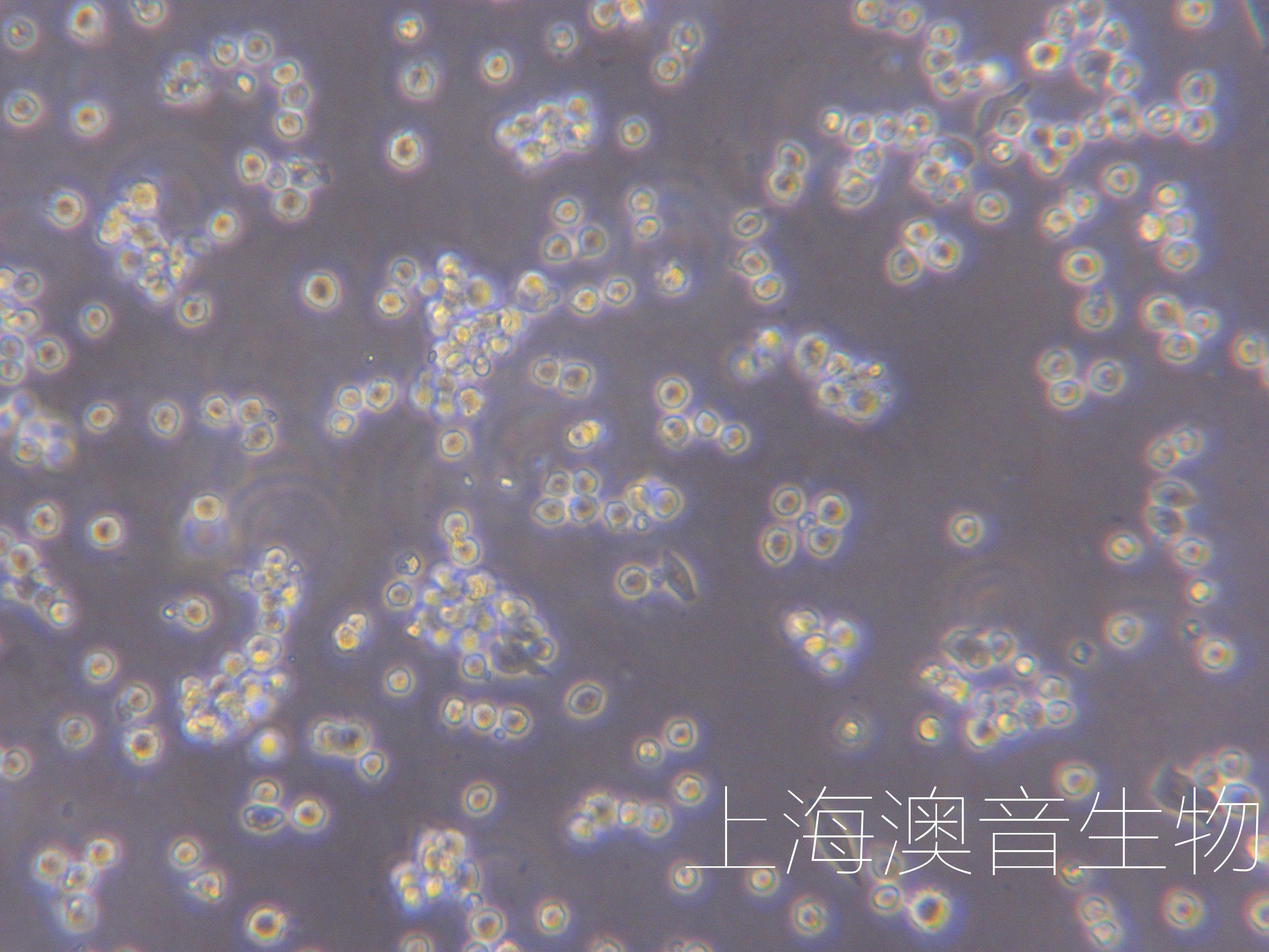 B95-8绒猴EBV转化的白细胞-企业官网