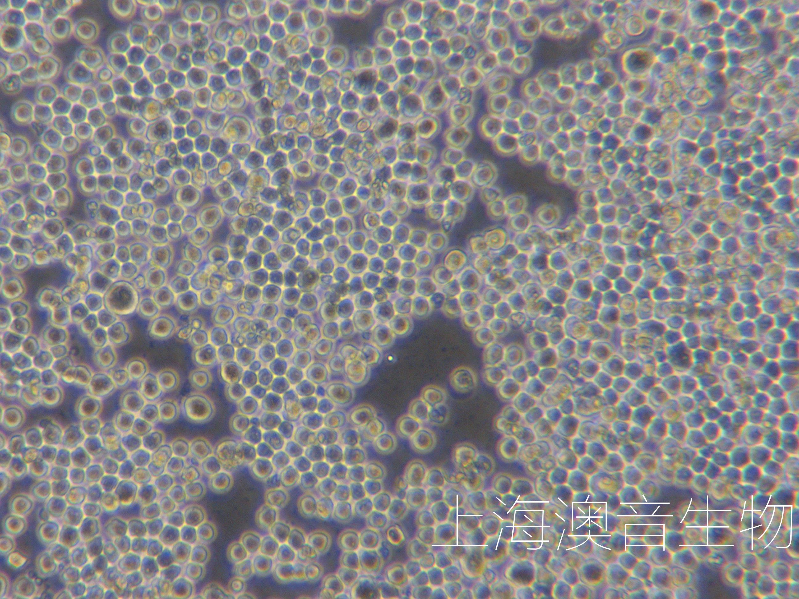SP2/0-Ag14小鼠骨髓瘤细胞-企业官网