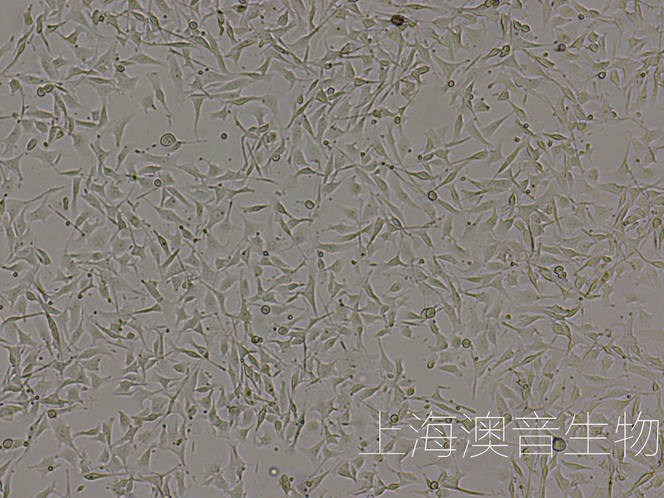 B16-OVA过表达OVA的小鼠黑色素瘤细胞-企业官网