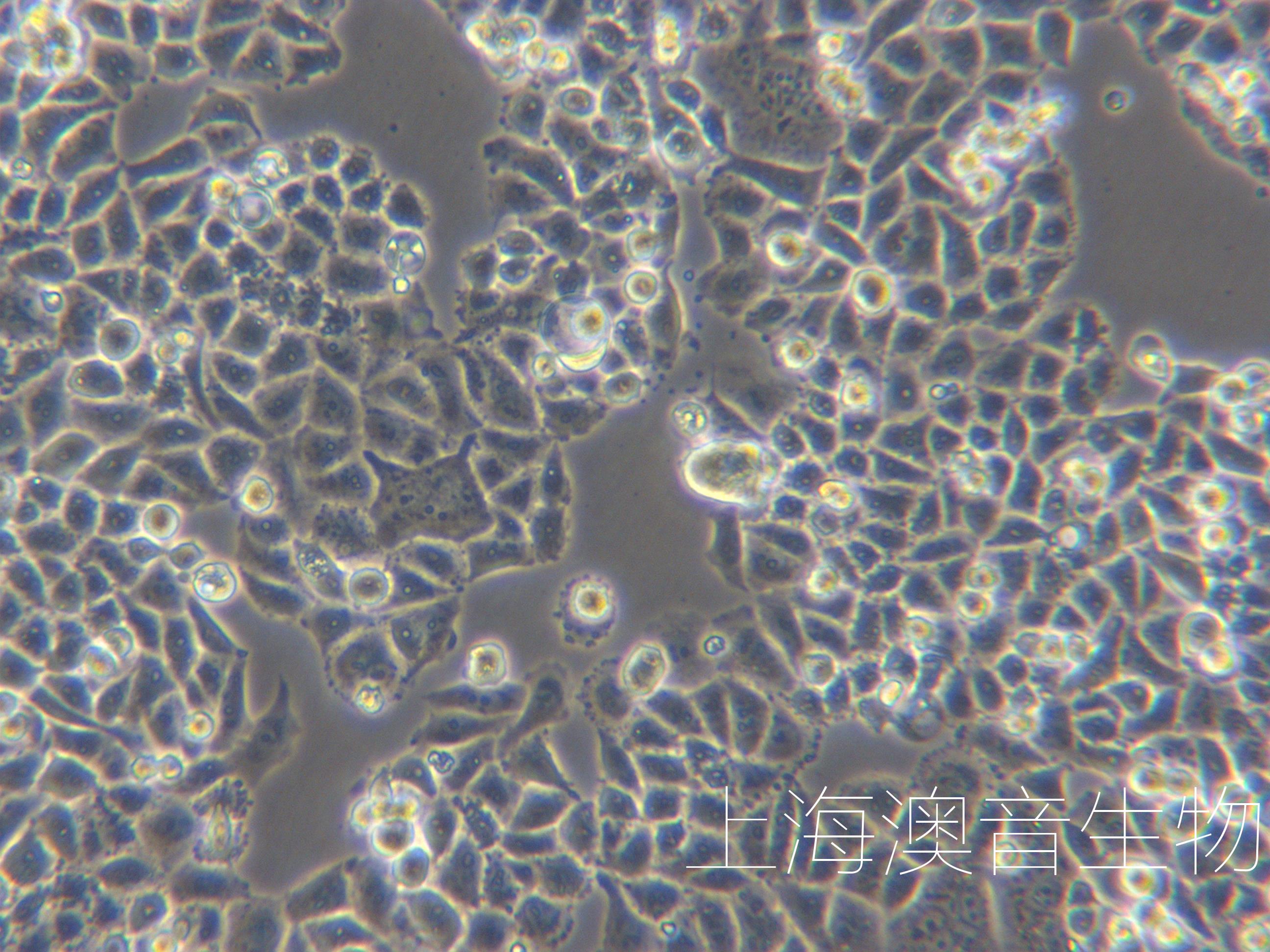 C-33A人子宫颈癌细胞-企业官网