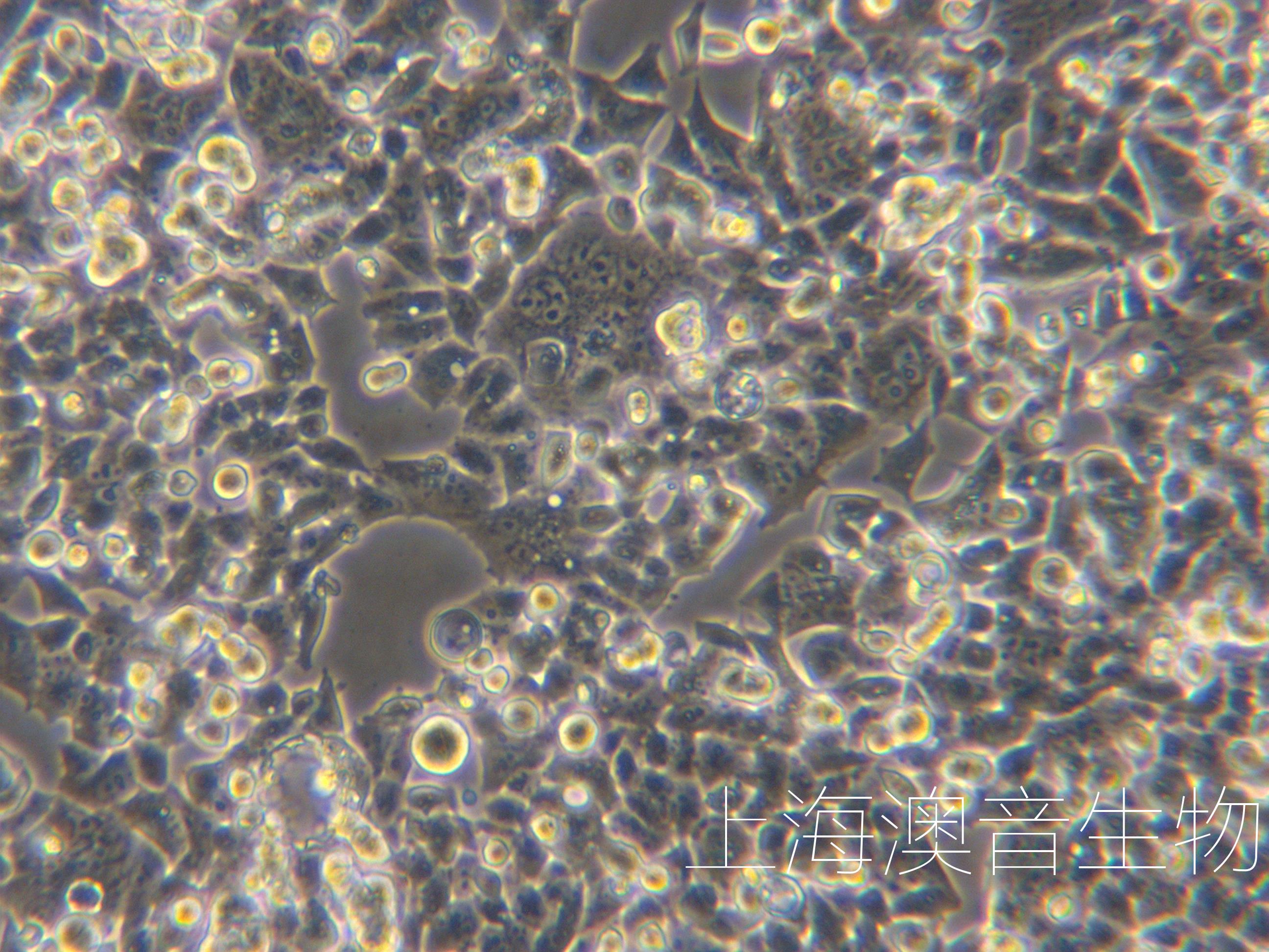 NCI-H520人肺鳞癌细胞-企业官网