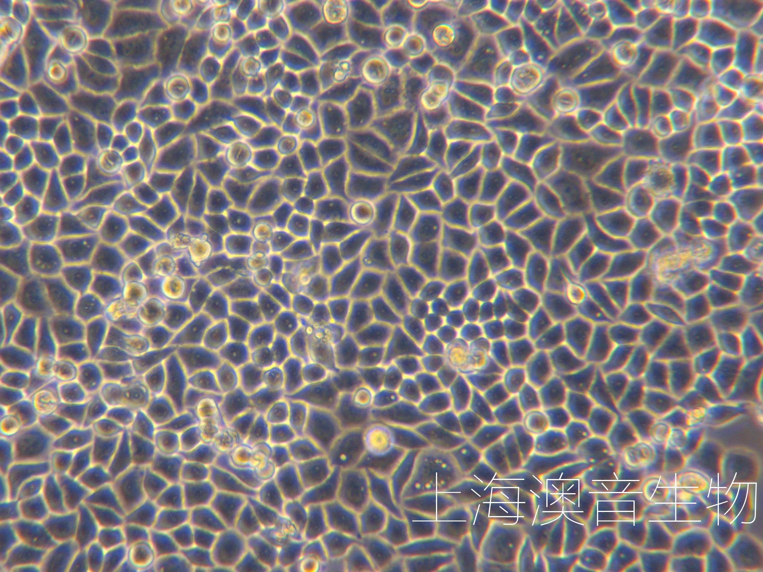 PC-9人肺癌细胞-企业官网