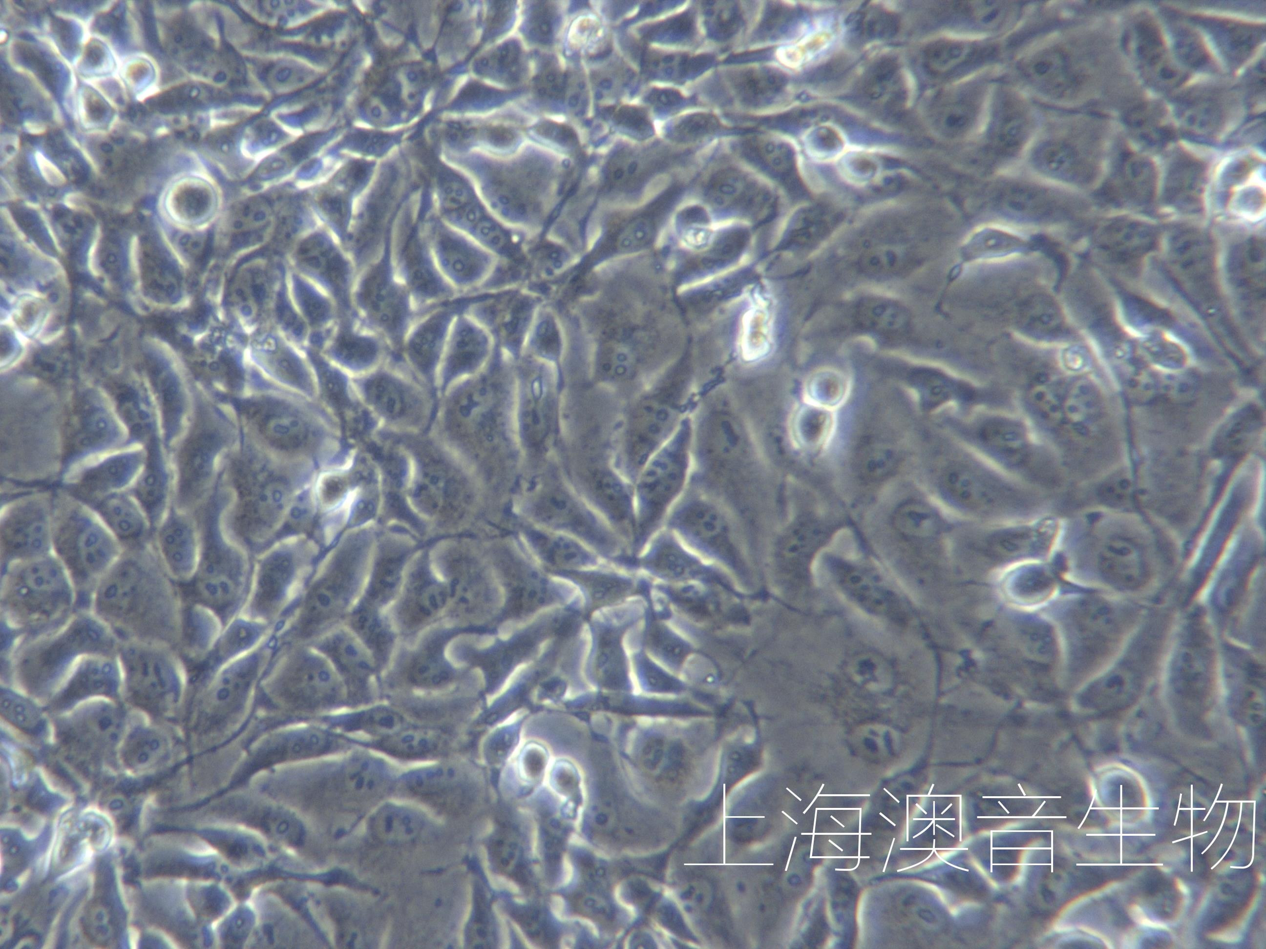 143B人骨肉瘤细胞（胸腺激酶缺陷细胞）-企业官网
