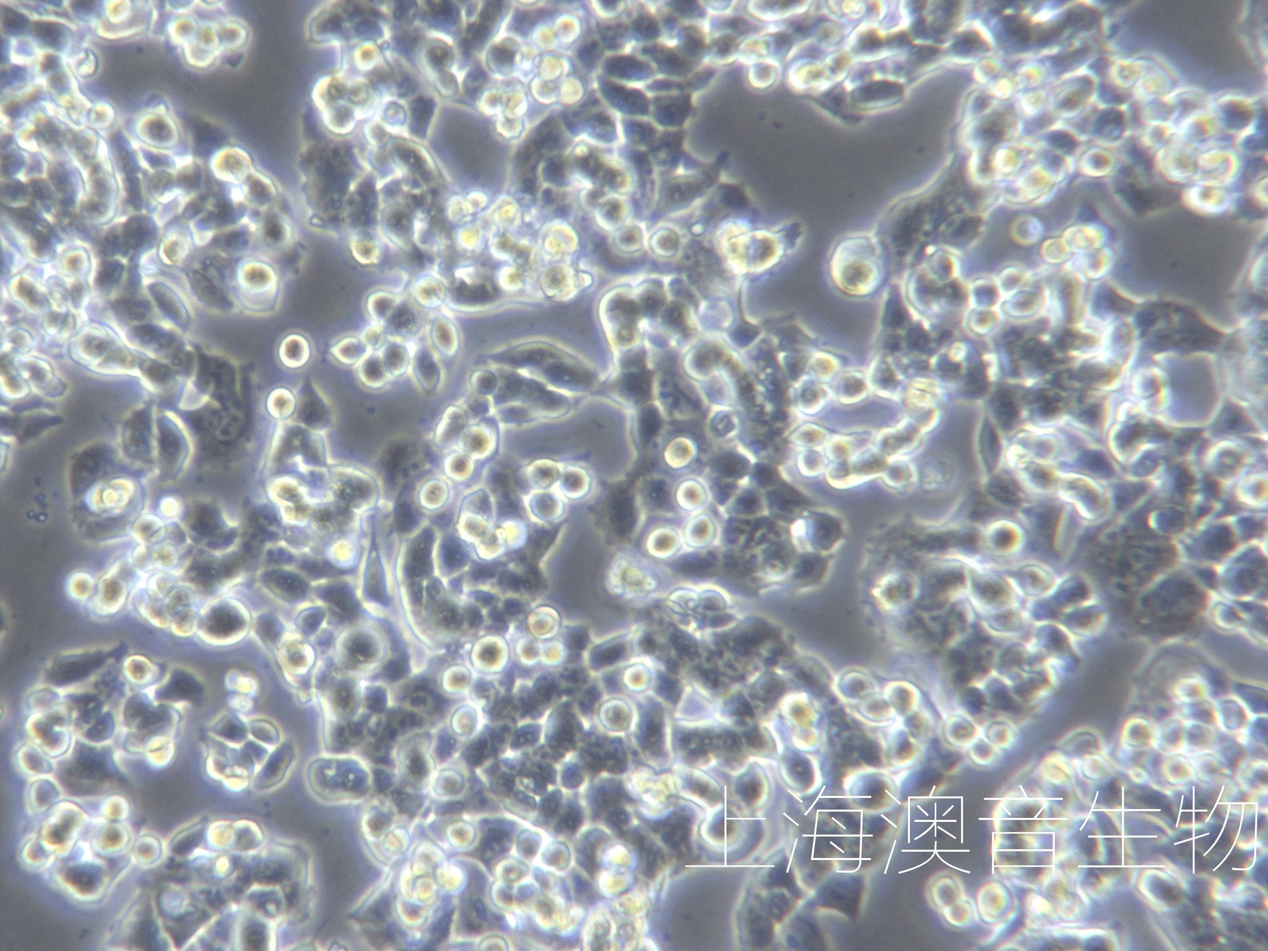 NCI-H520人肺鳞癌细胞-企业官网
