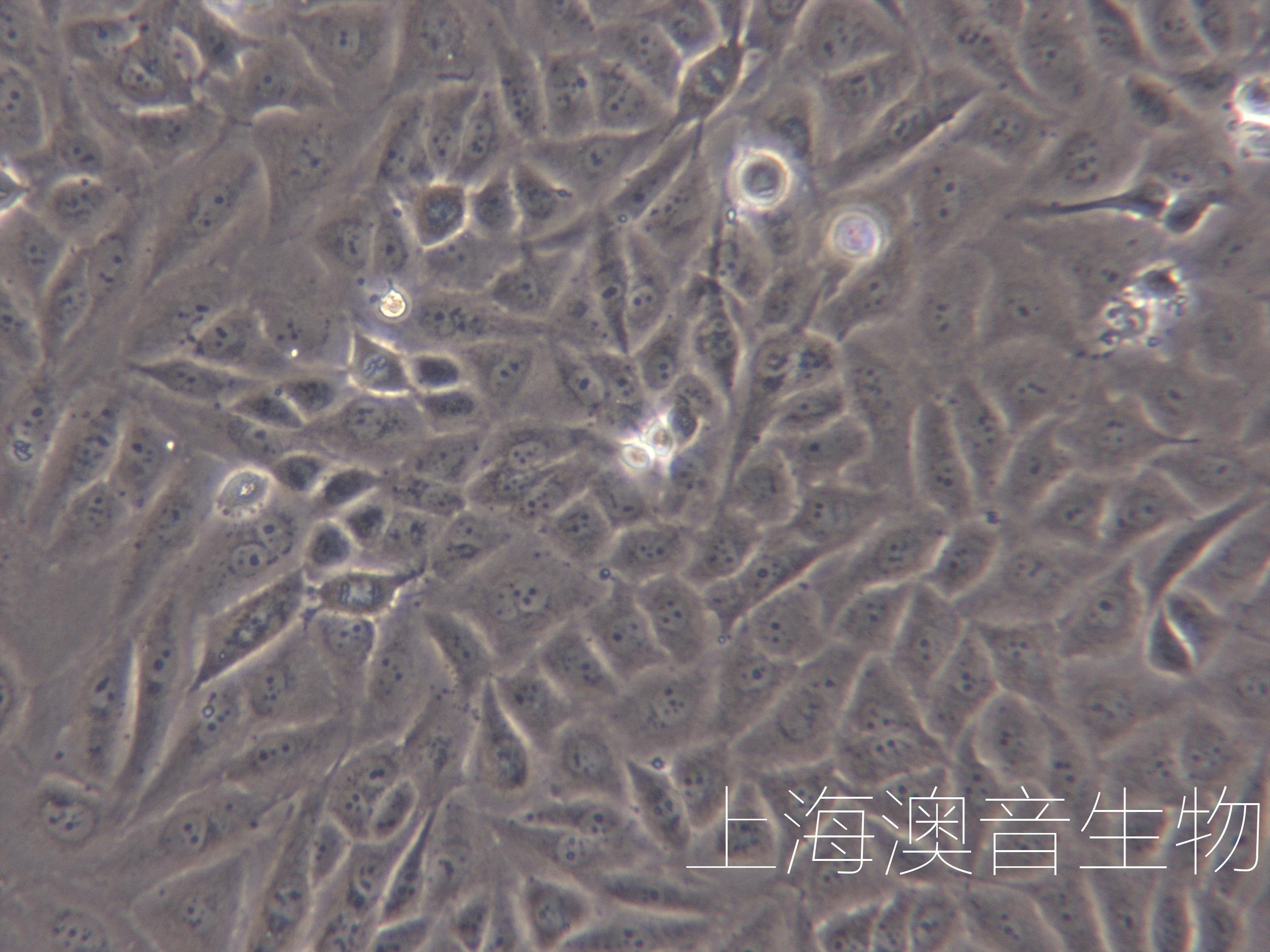 J82人膀胱移行癌细胞-企业官网