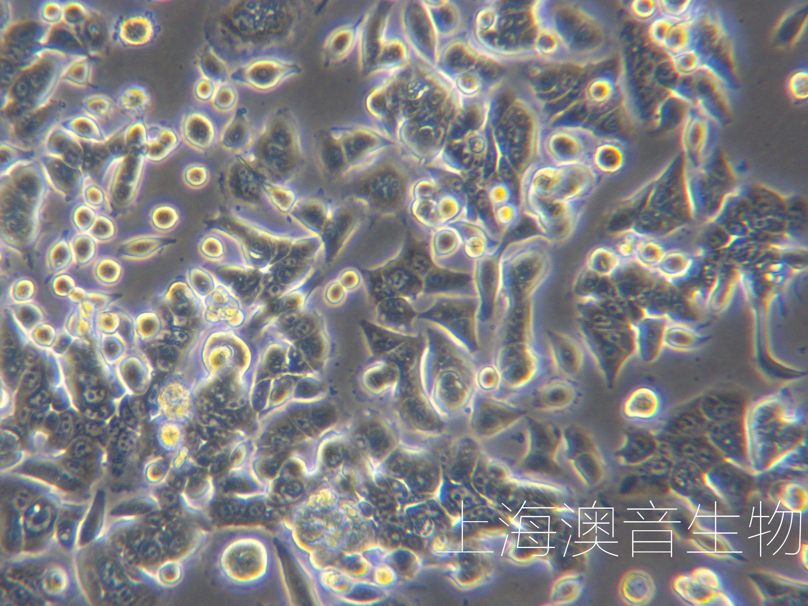 ASPC-1人胰腺癌细胞-企业官网