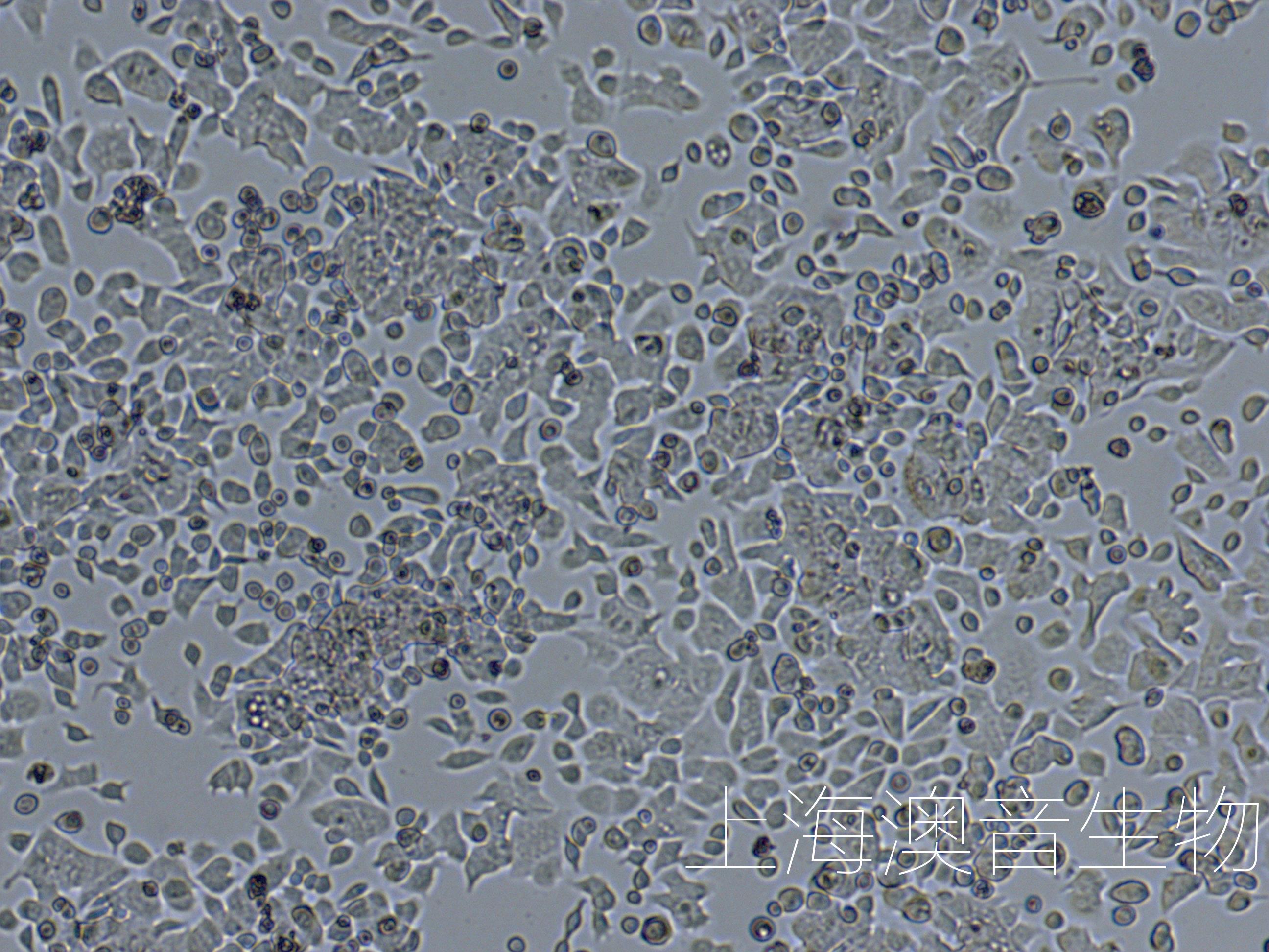 ASPC-1人胰腺癌细胞-企业官网