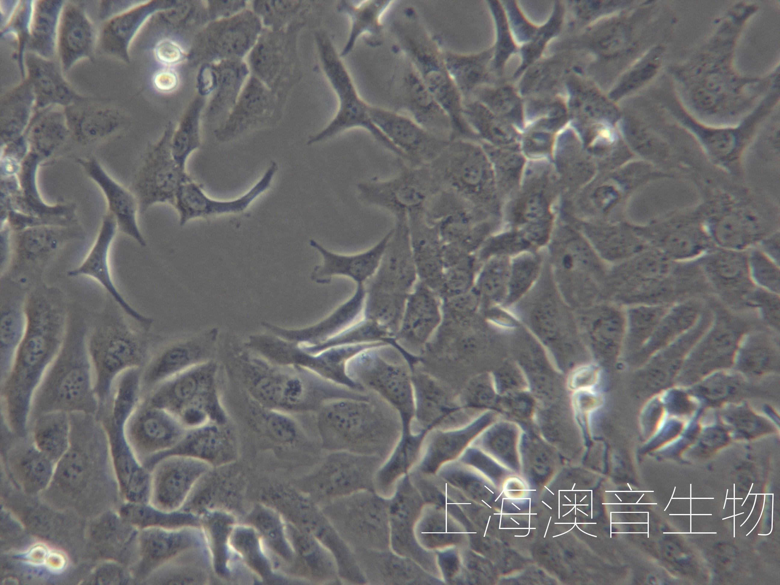 SK-OV-3人卵巢癌细胞-企业官网