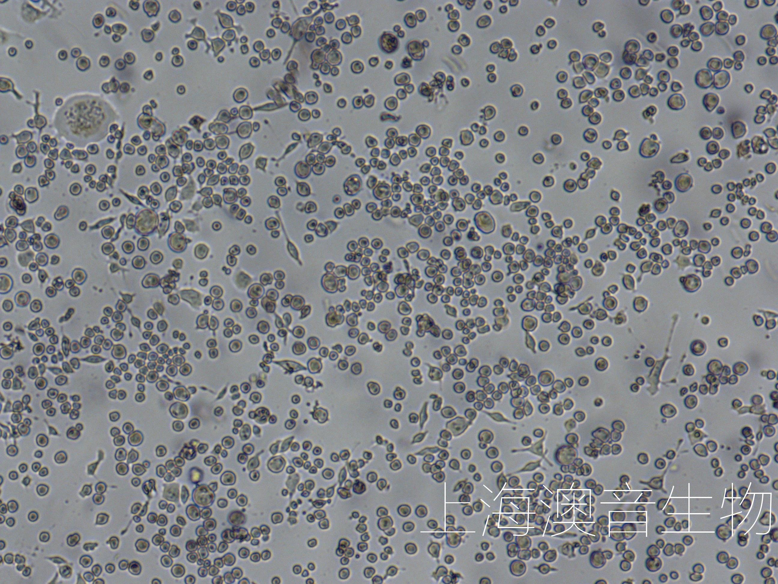H22小鼠肝癌细胞系-企业官网