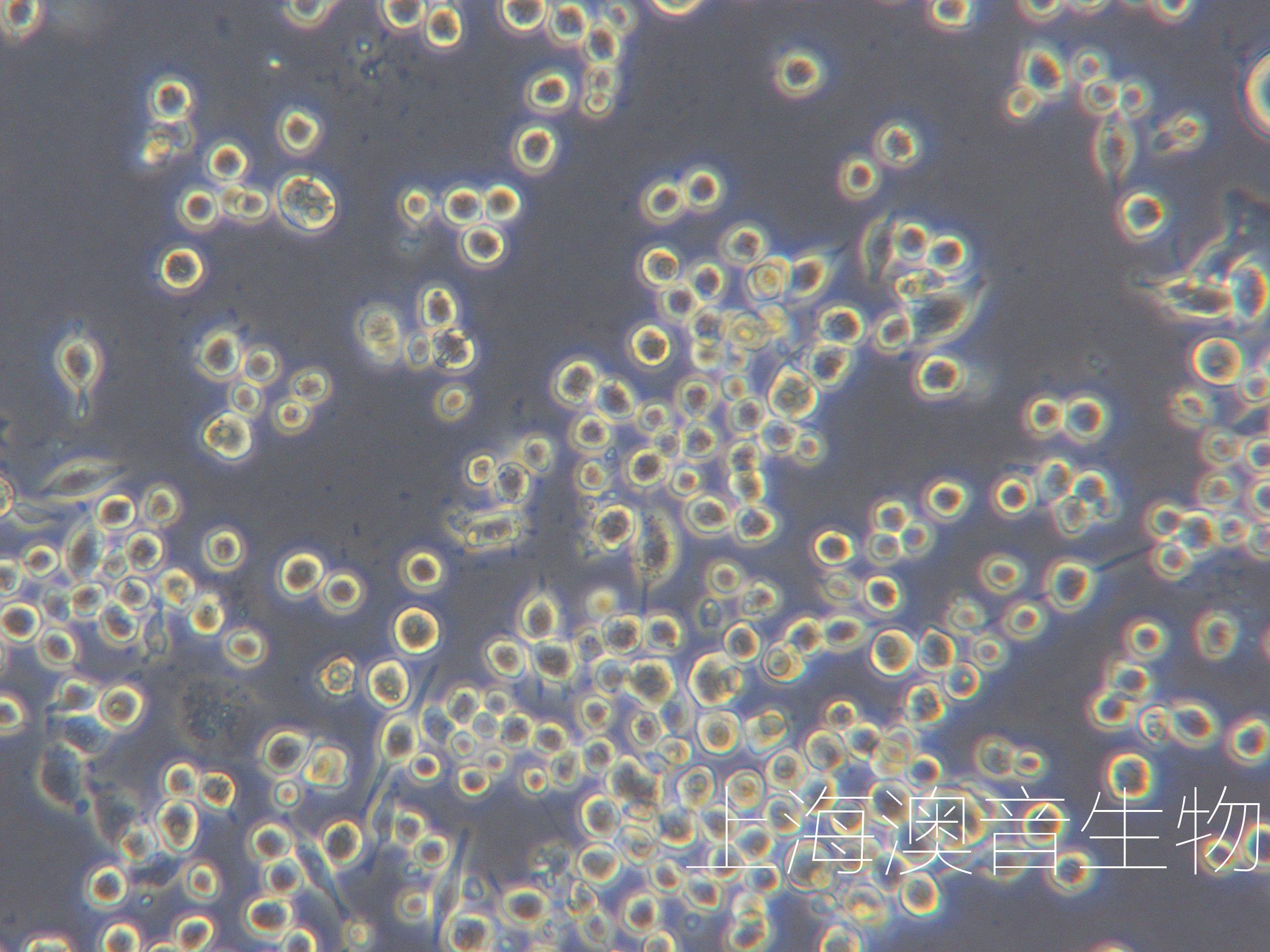 H22小鼠肝癌细胞系-企业官网