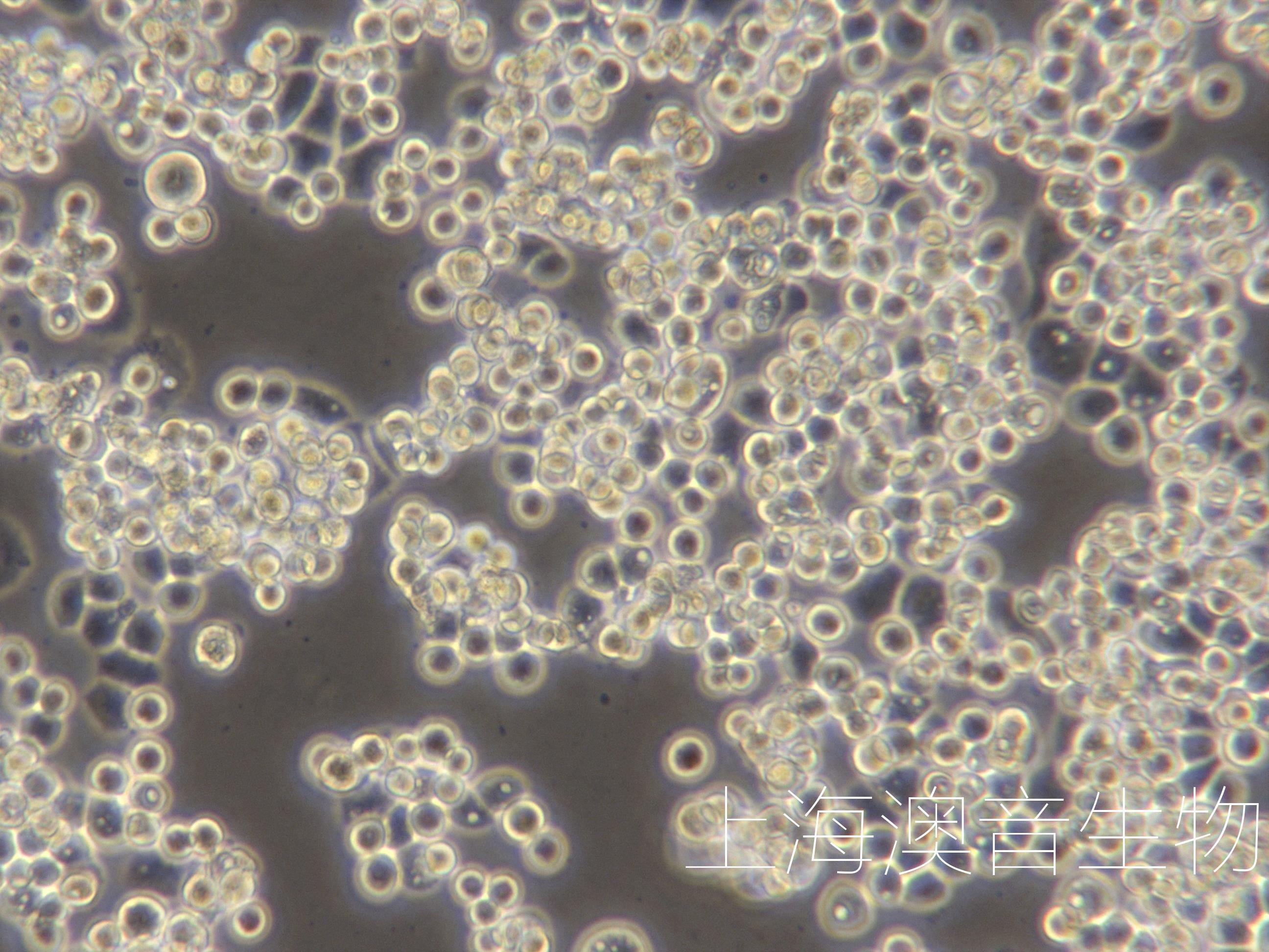 MDA-MB-453人乳腺癌细胞-企业官网
