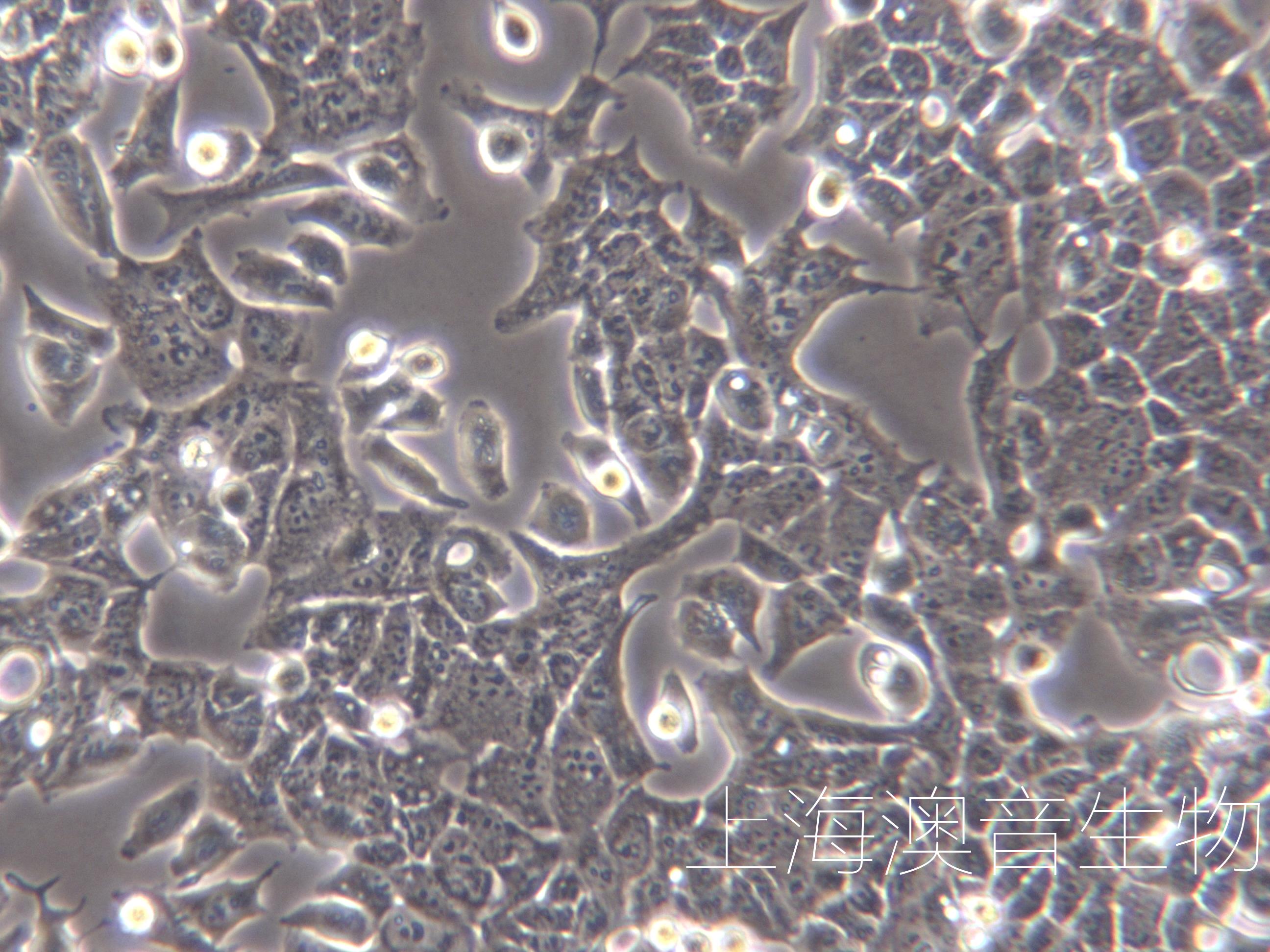 HEC-1-B人子宫内膜腺癌细胞-企业官网
