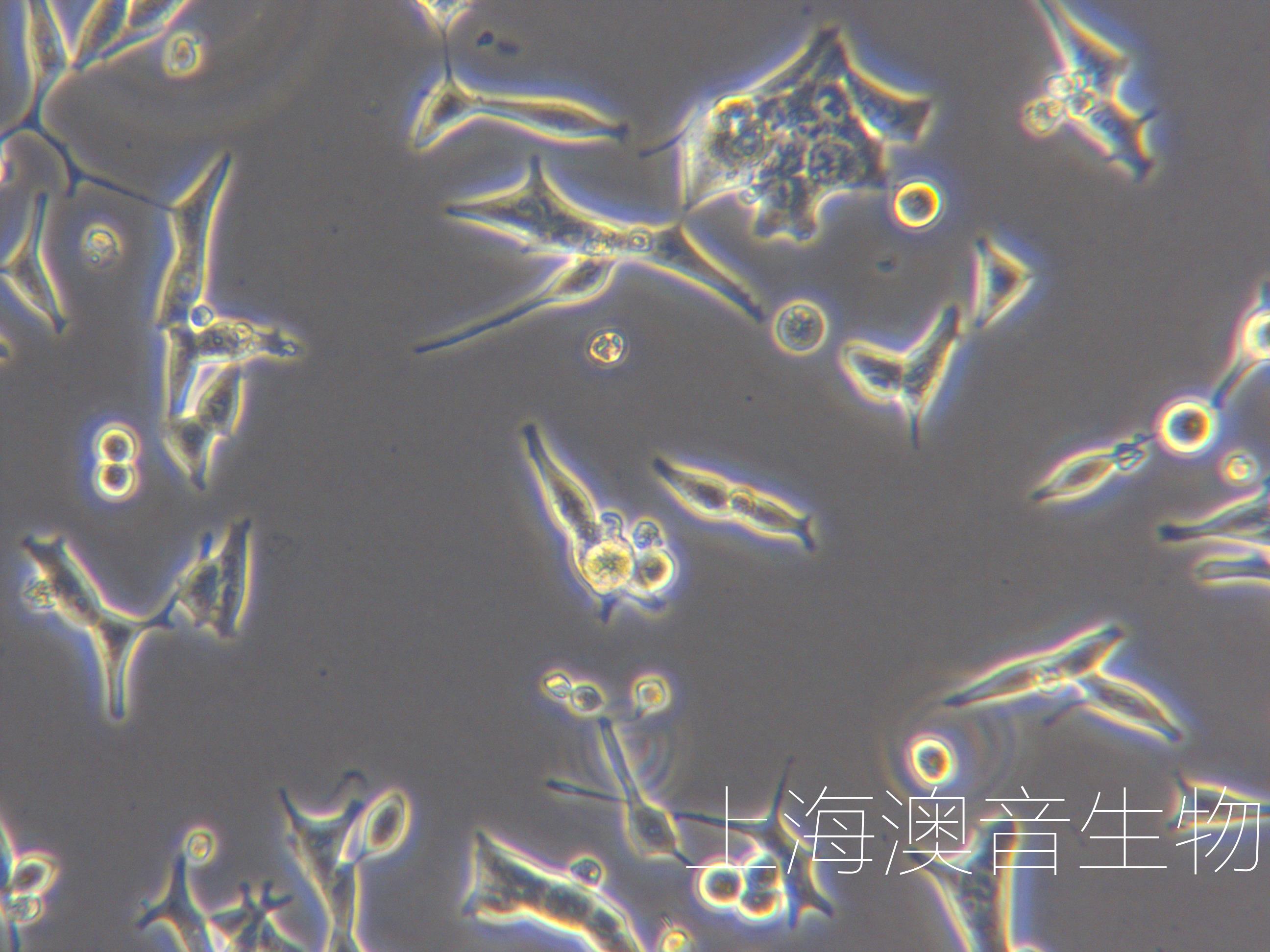 LNcap clone FGC人前列腺癌细胞-企业官网