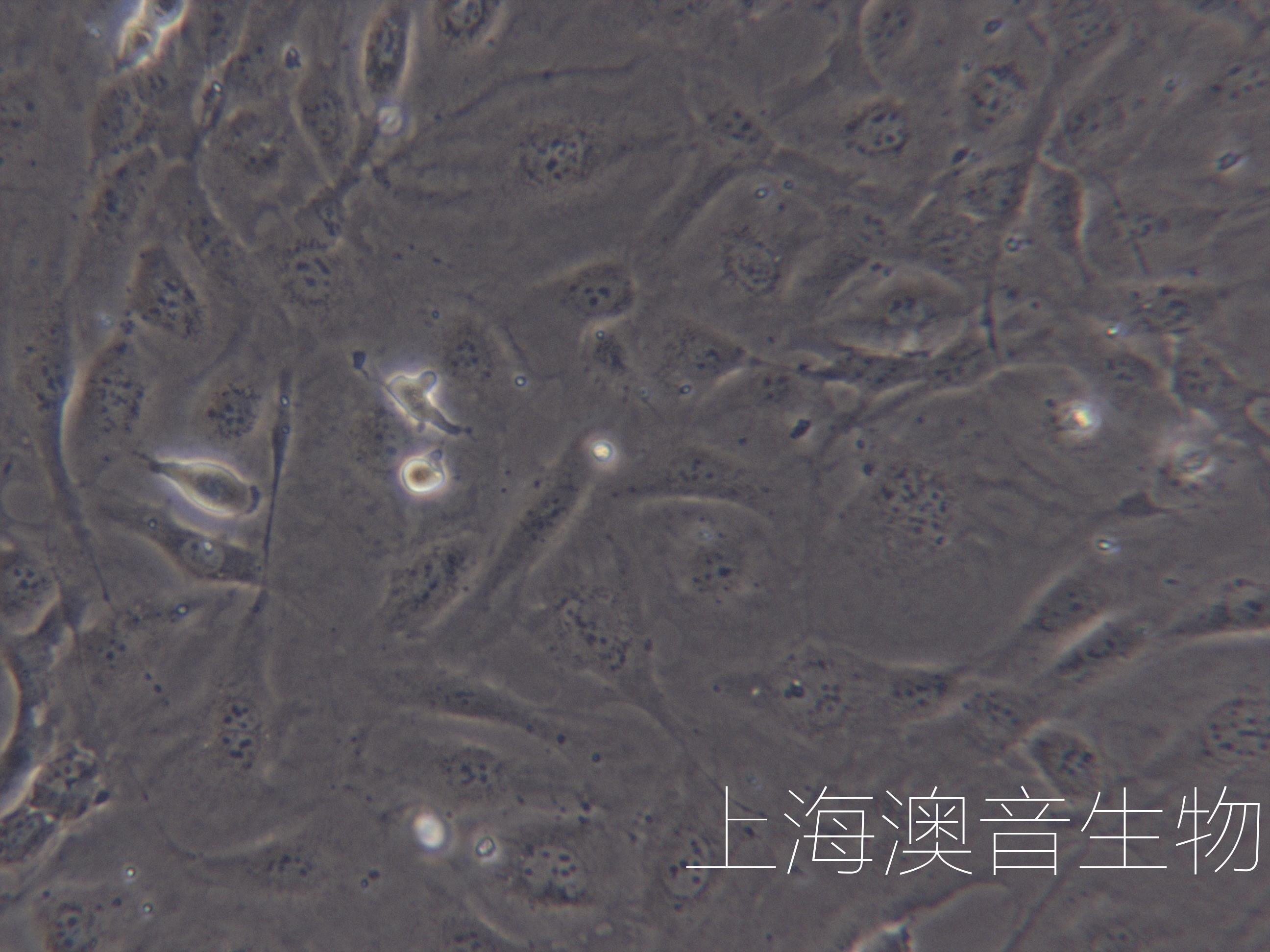 SVEC4-10小鼠淋巴结血管上皮样细胞-企业官网