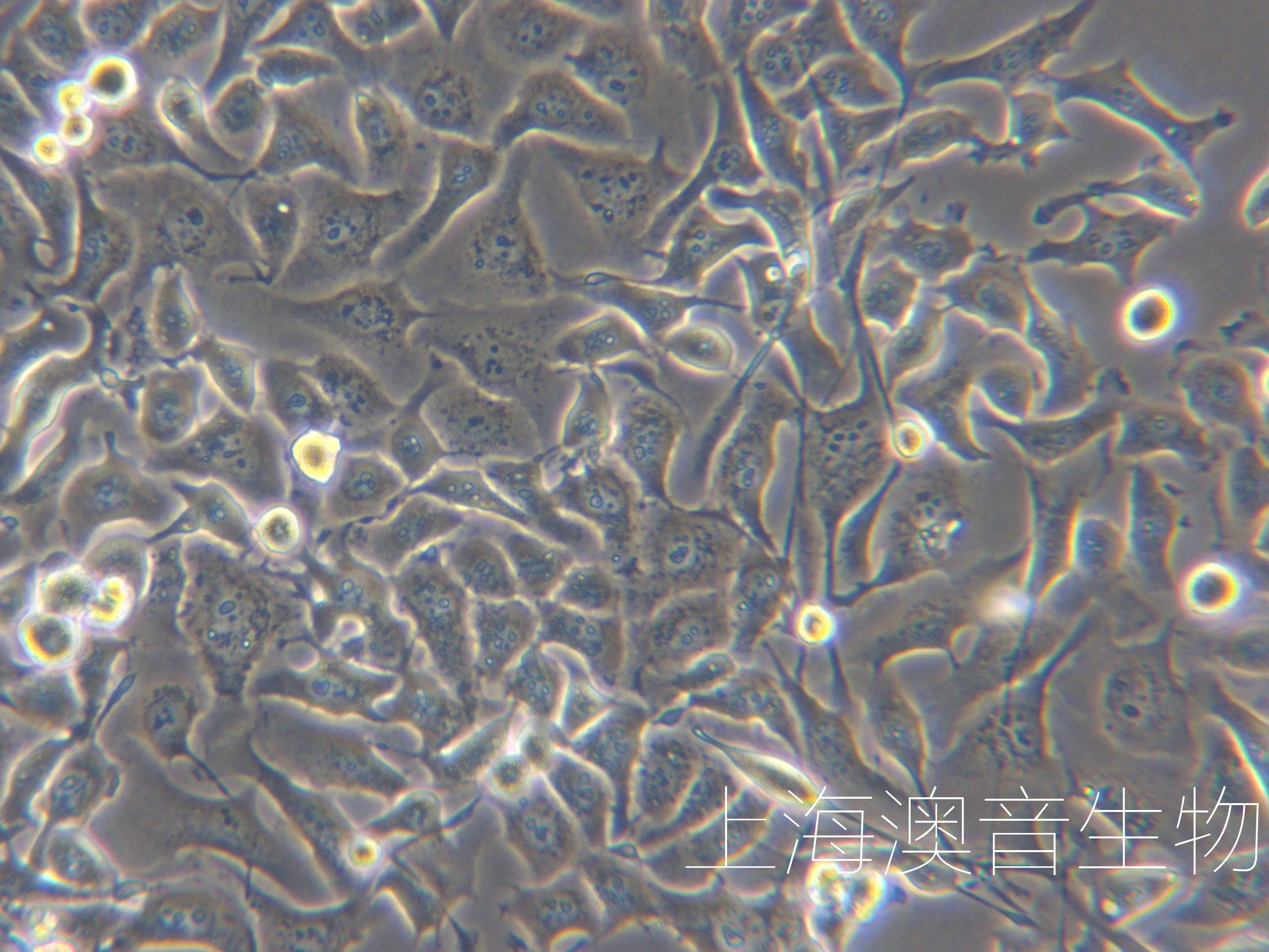 人鼻咽癌细胞CNE2-企业官网