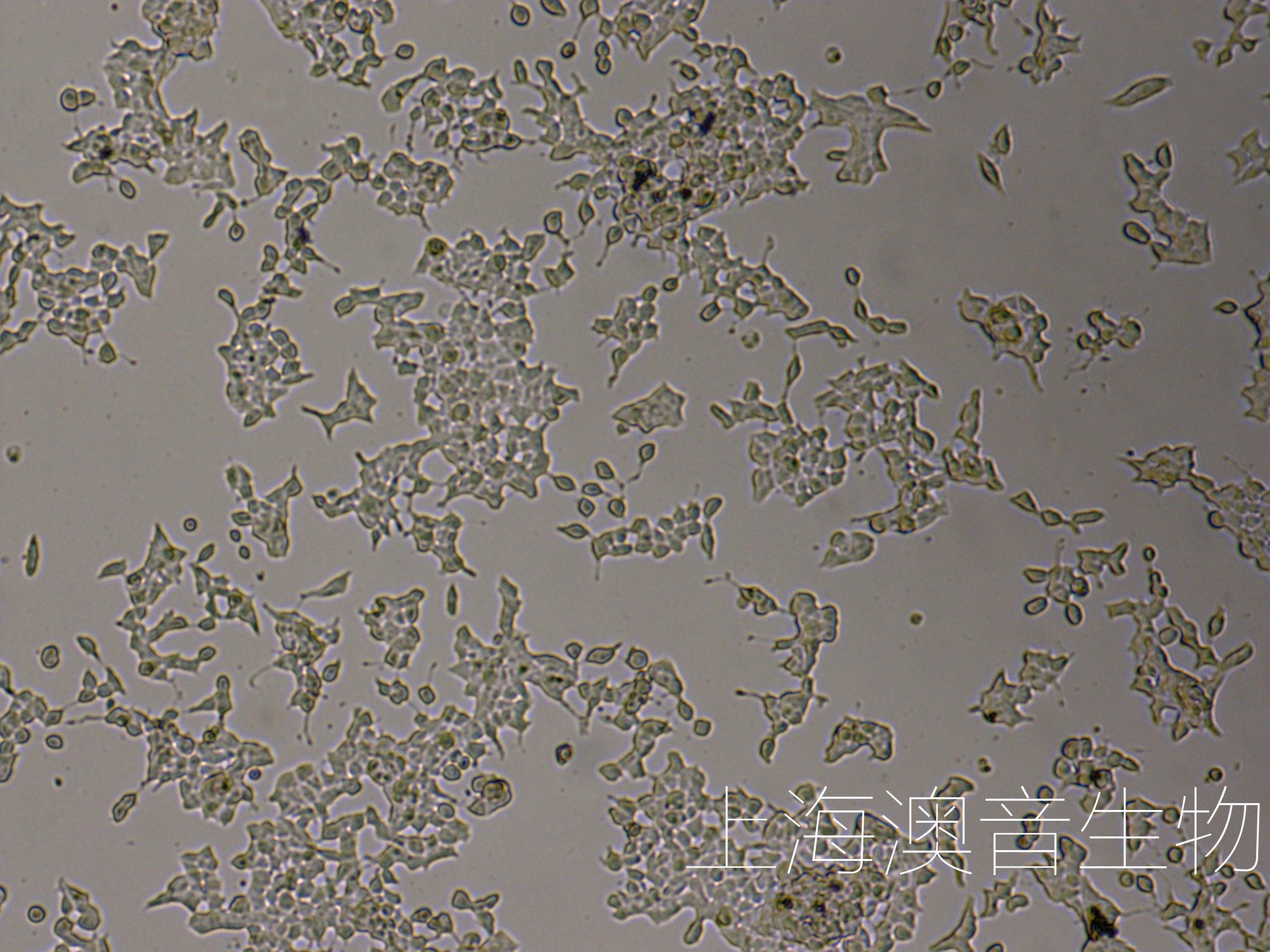 INS-1大鼠胰岛素瘤细胞-企业官网
