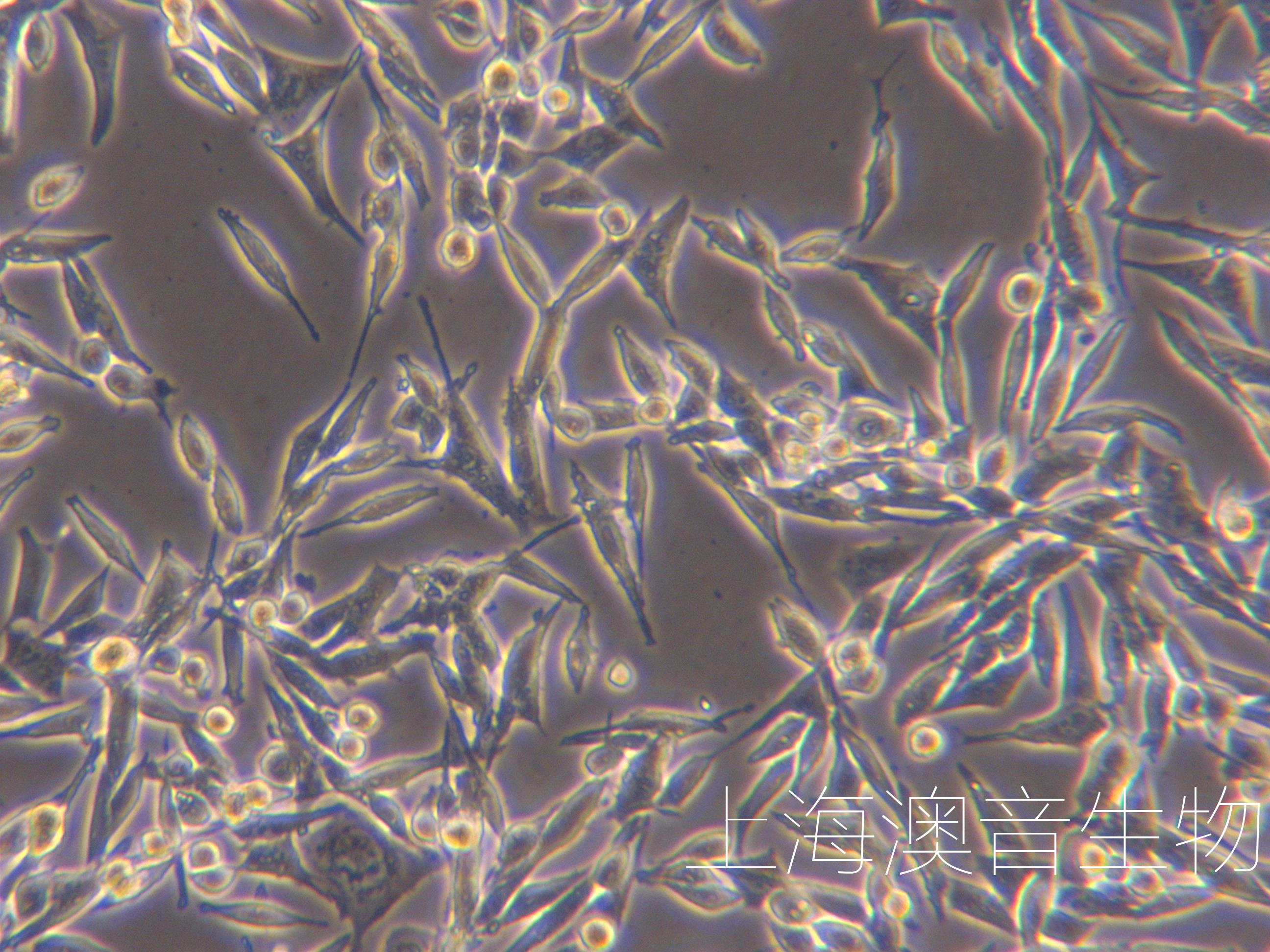 PANC02小鼠胰腺导管腺癌细胞-企业官网