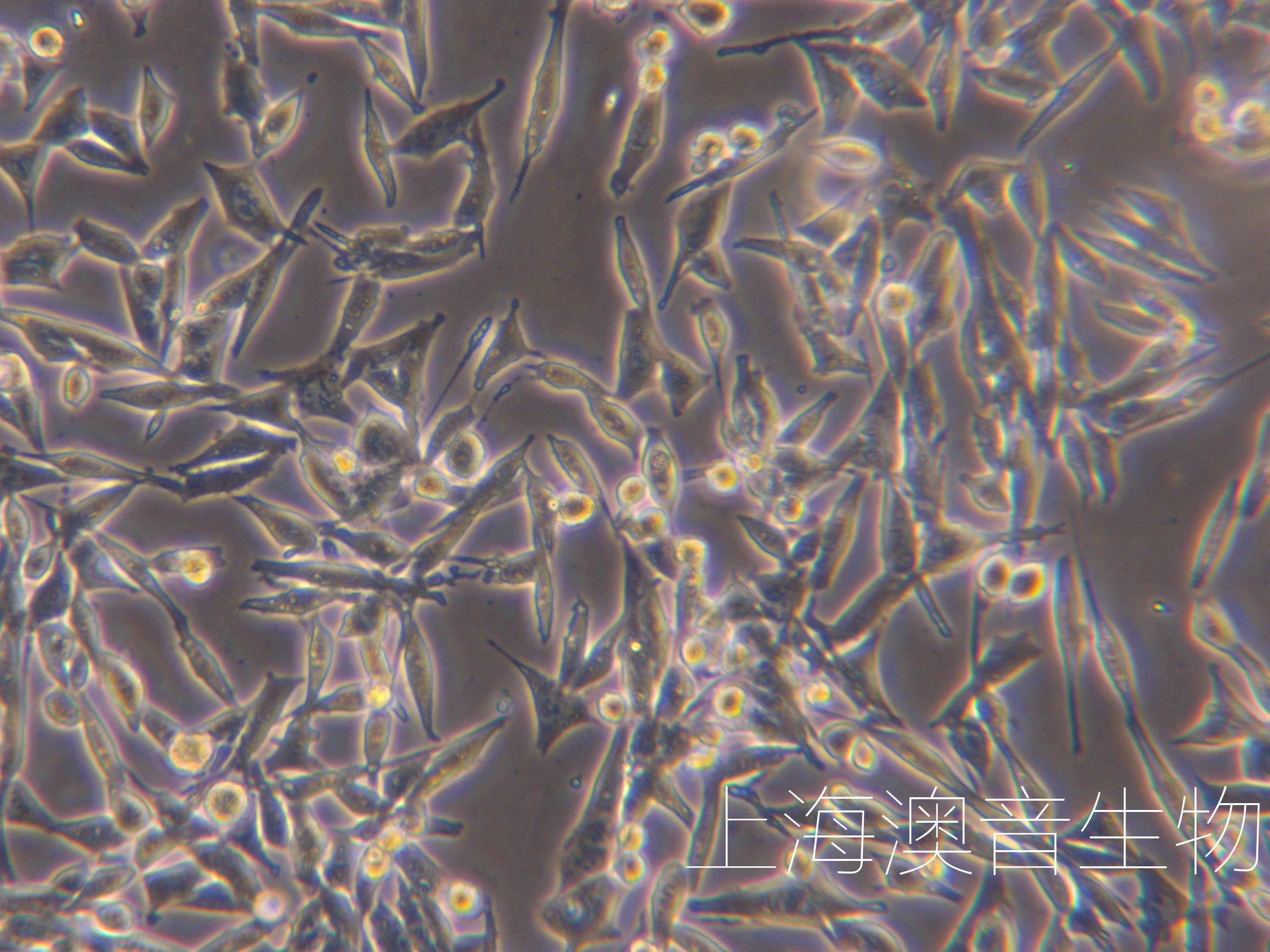 PANC02小鼠胰腺导管腺癌细胞-企业官网