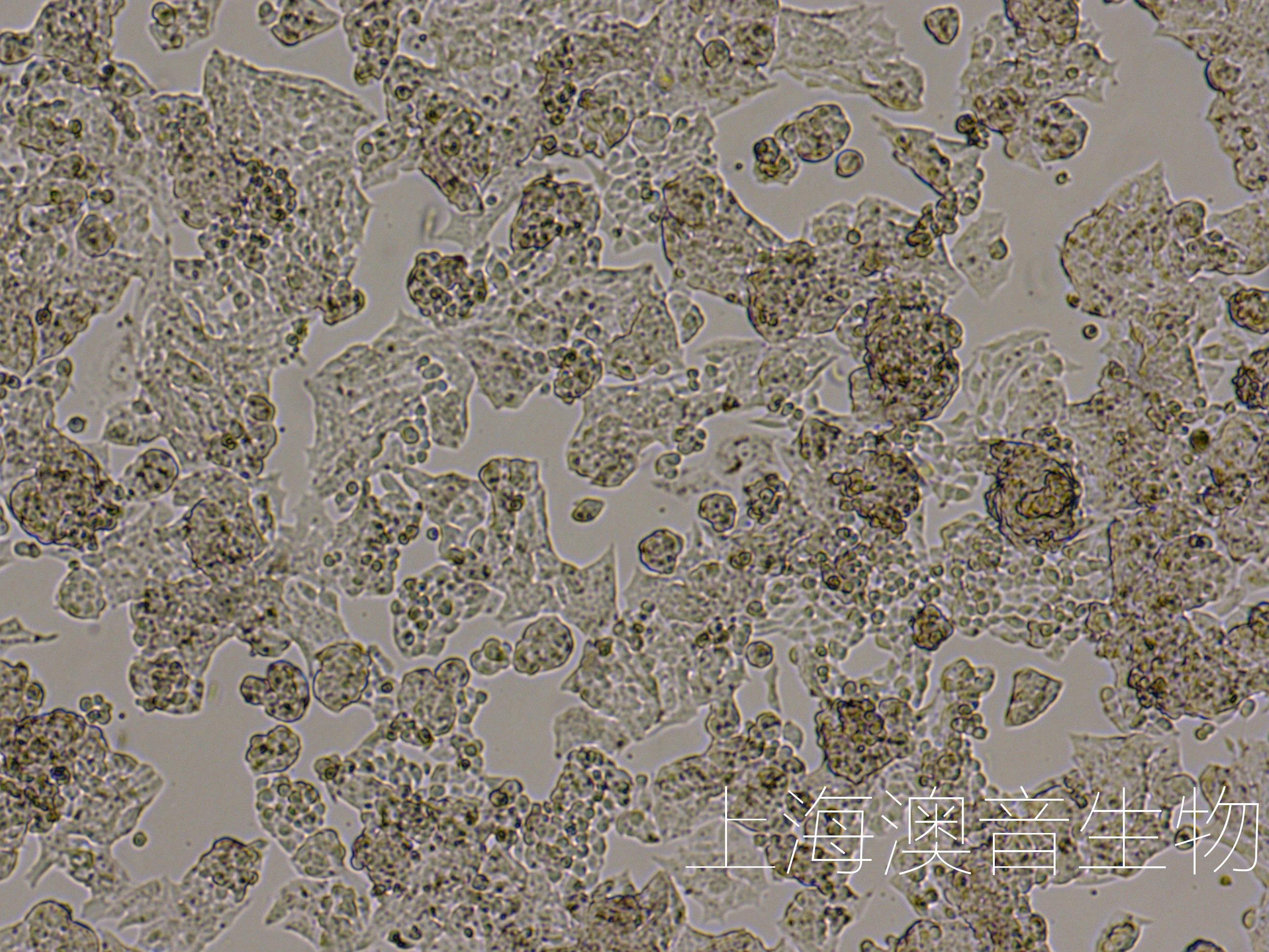 A2780人卵巢癌细胞-企业官网