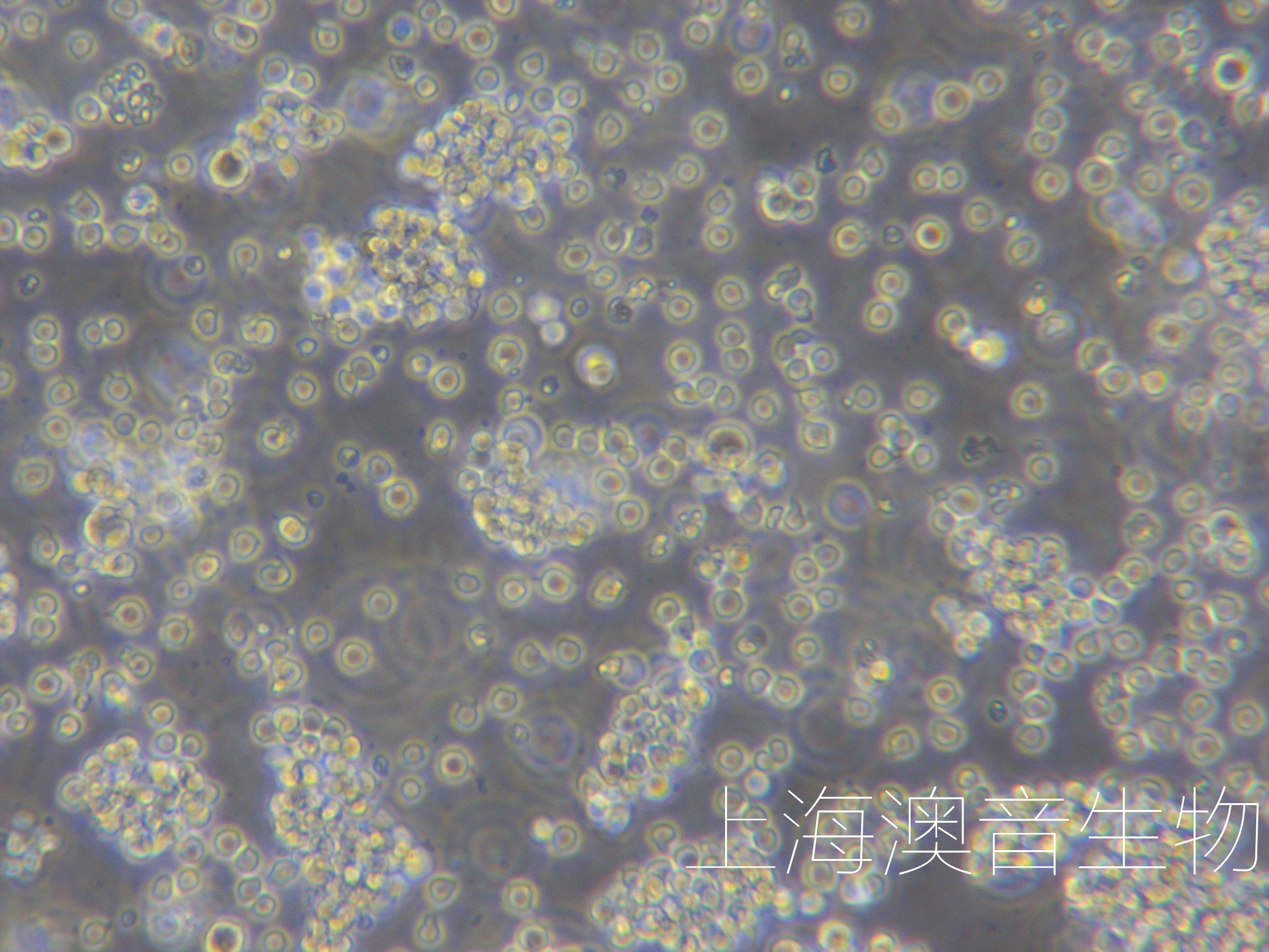 人T淋巴细胞白血病细胞Jurkat clone E6-1-企业官网