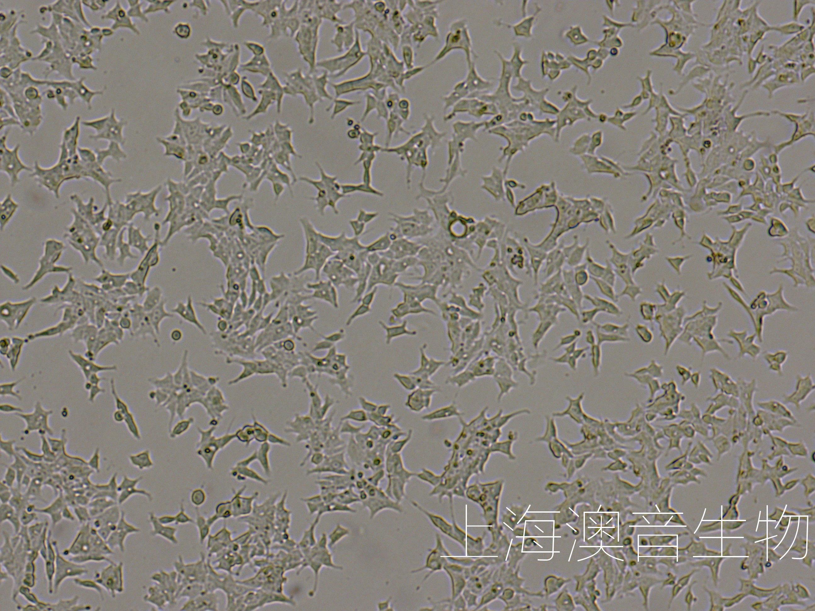 22Rv1人前列腺癌细胞-企业官网