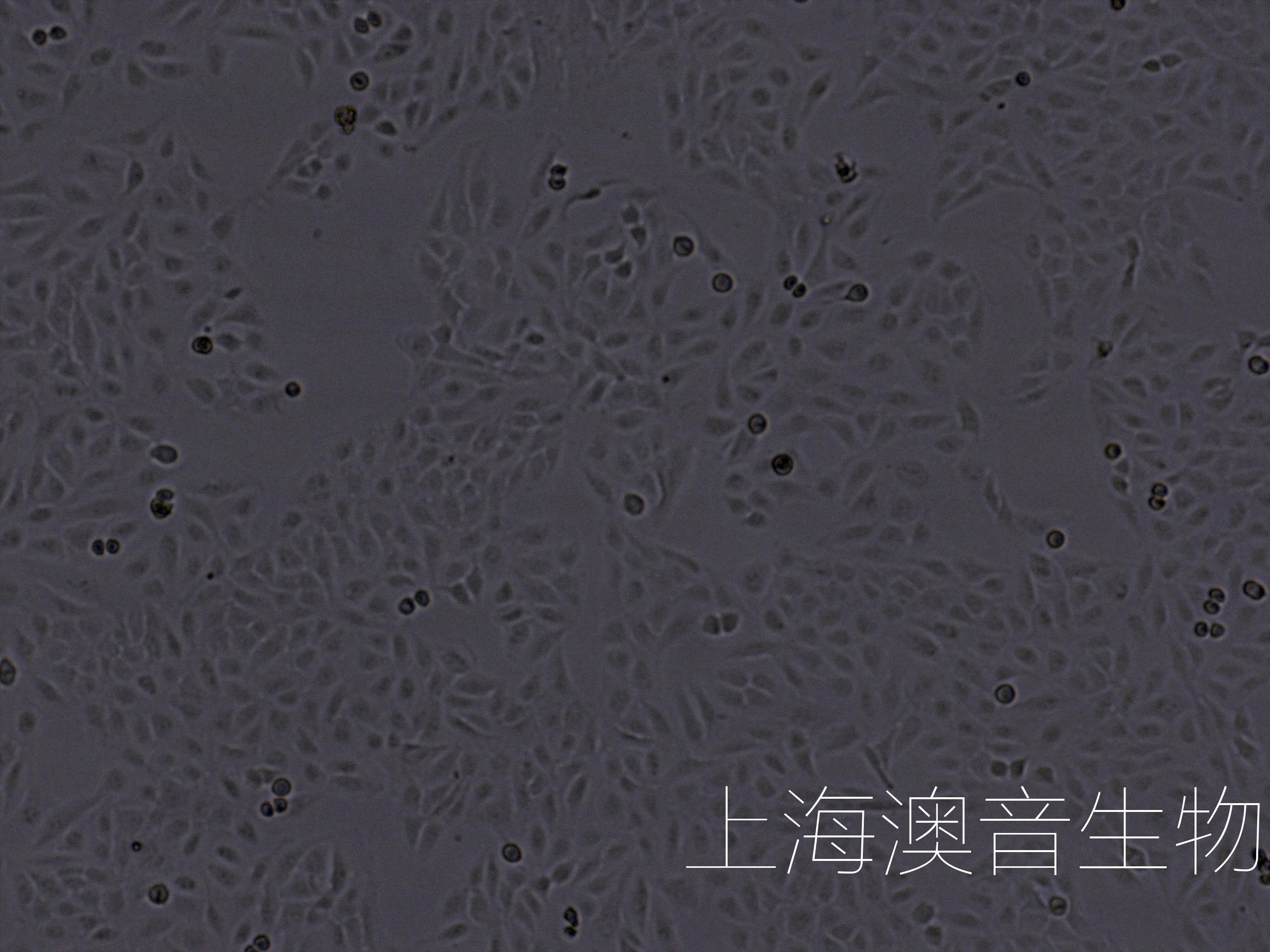 U-2 OS人骨肉瘤细胞-企业官网