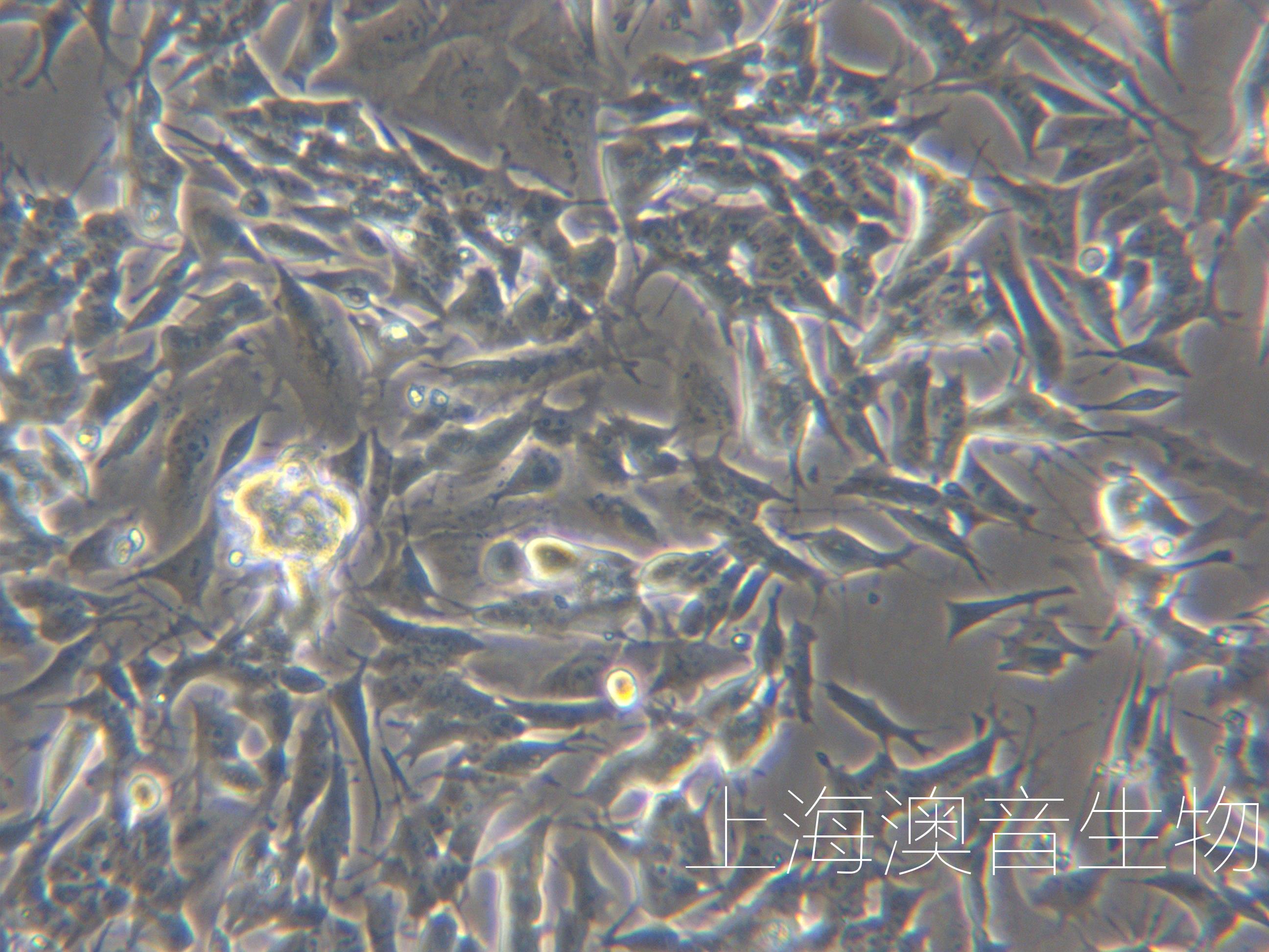 SH-SY5Y人神经母细胞瘤细胞-企业官网