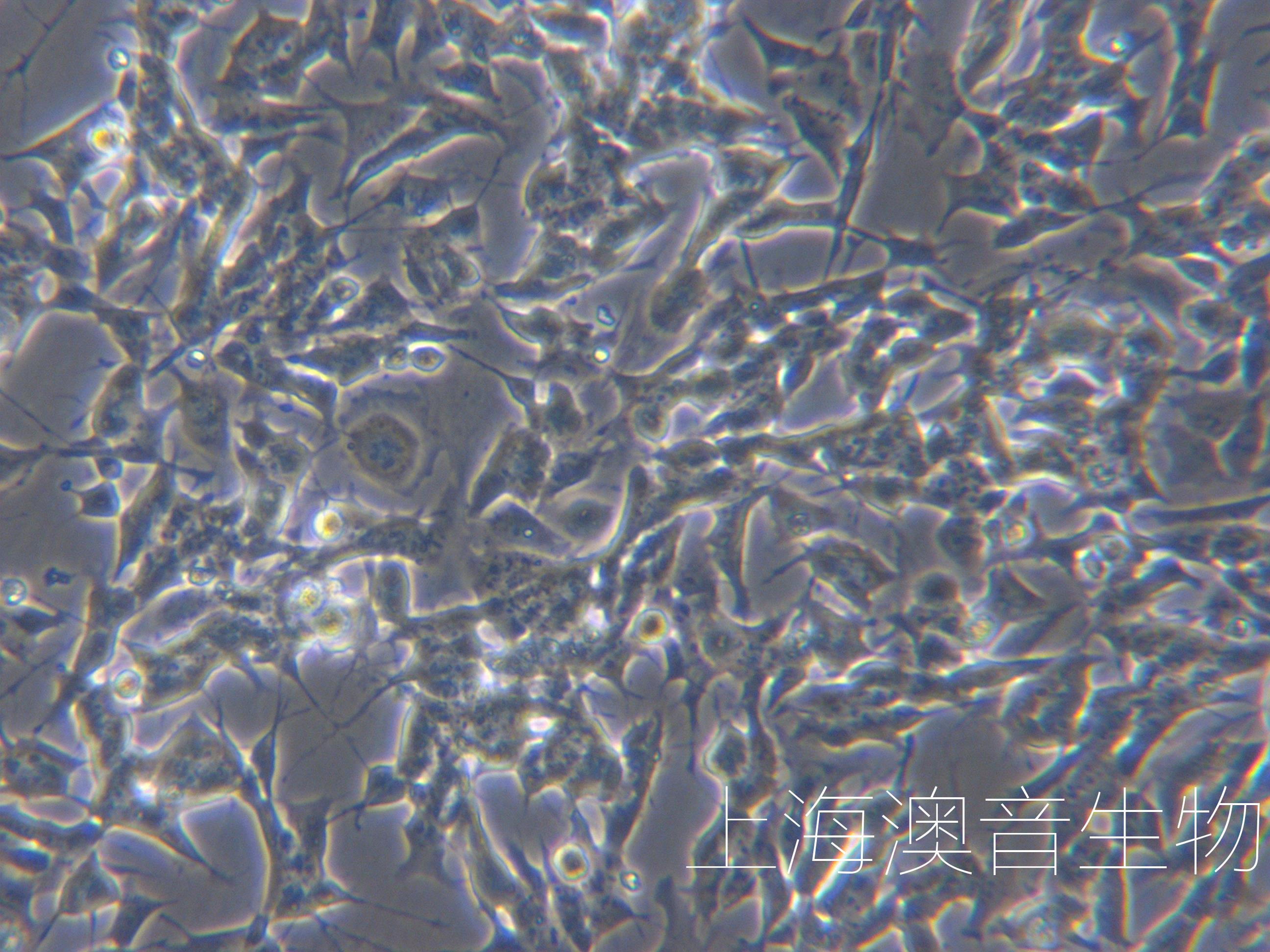 SH-SY5Y人神经母细胞瘤细胞-企业官网