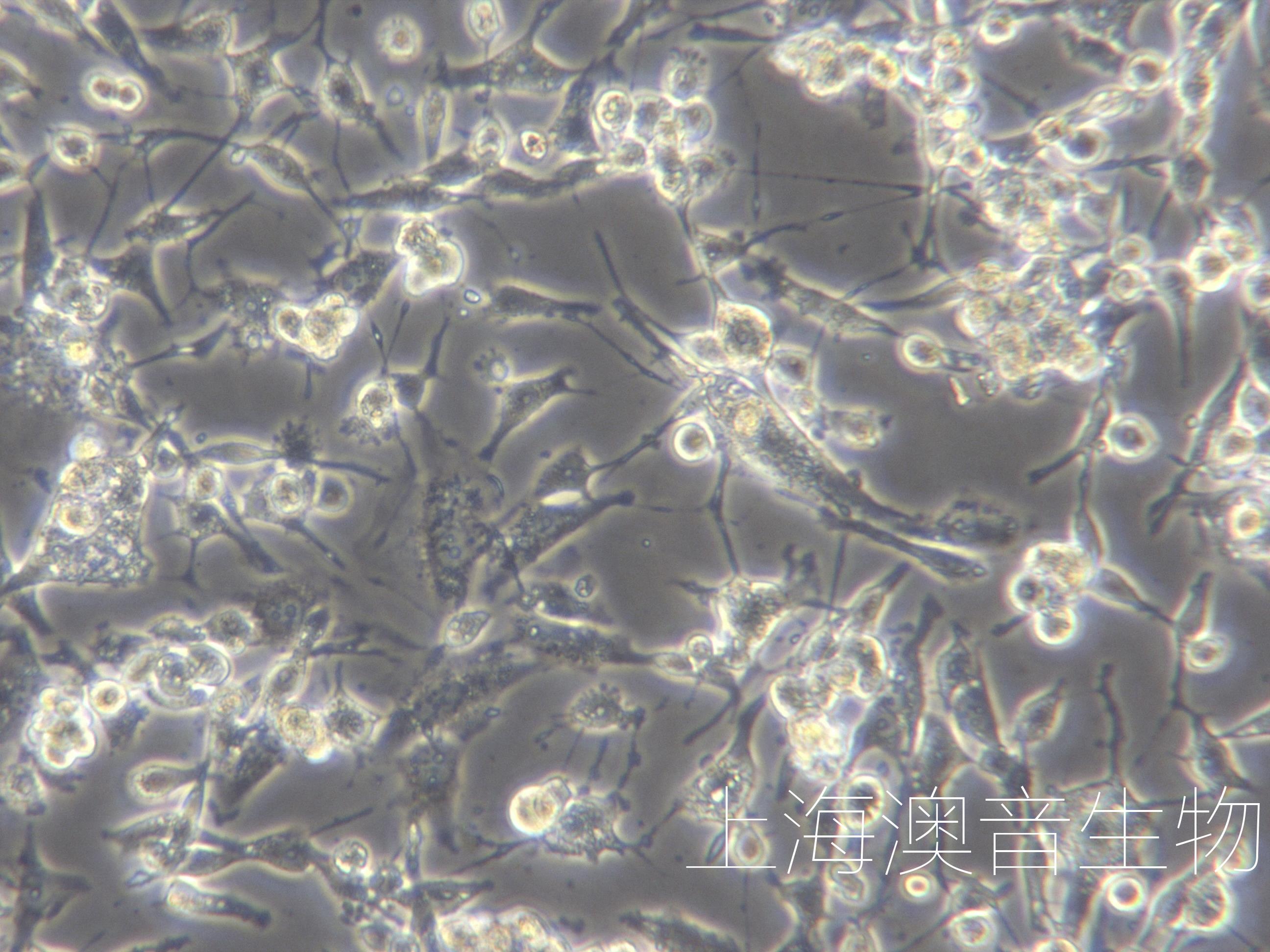 MDA-MB-436人乳腺腺癌细胞-企业官网