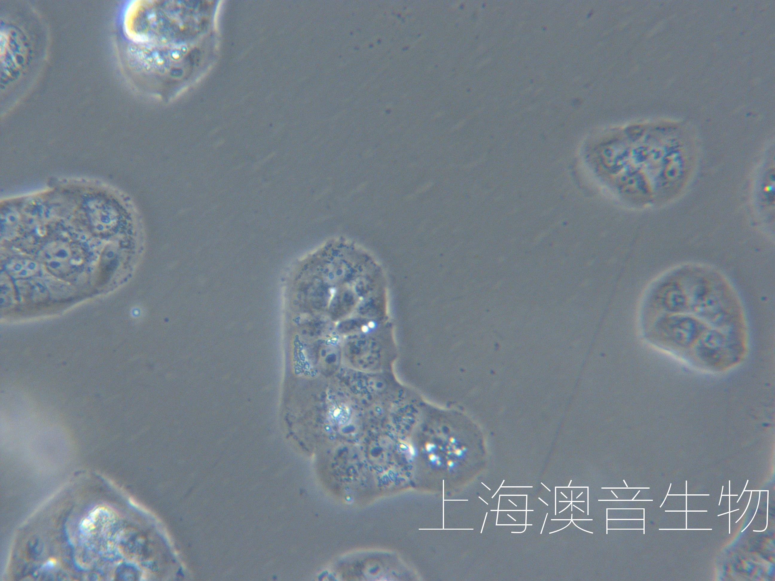 NCI-H441人肺腺癌细胞-企业官网
