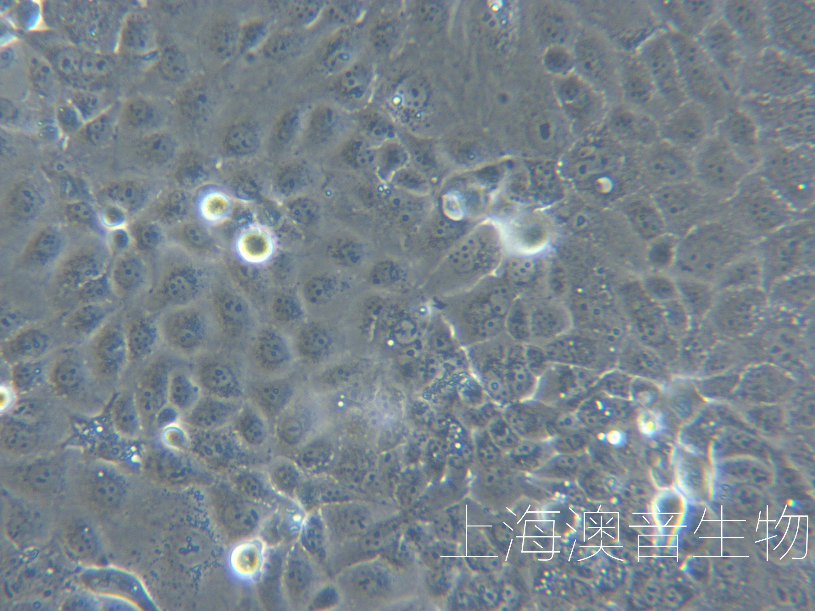 NCI-H441人肺腺癌细胞-企业官网