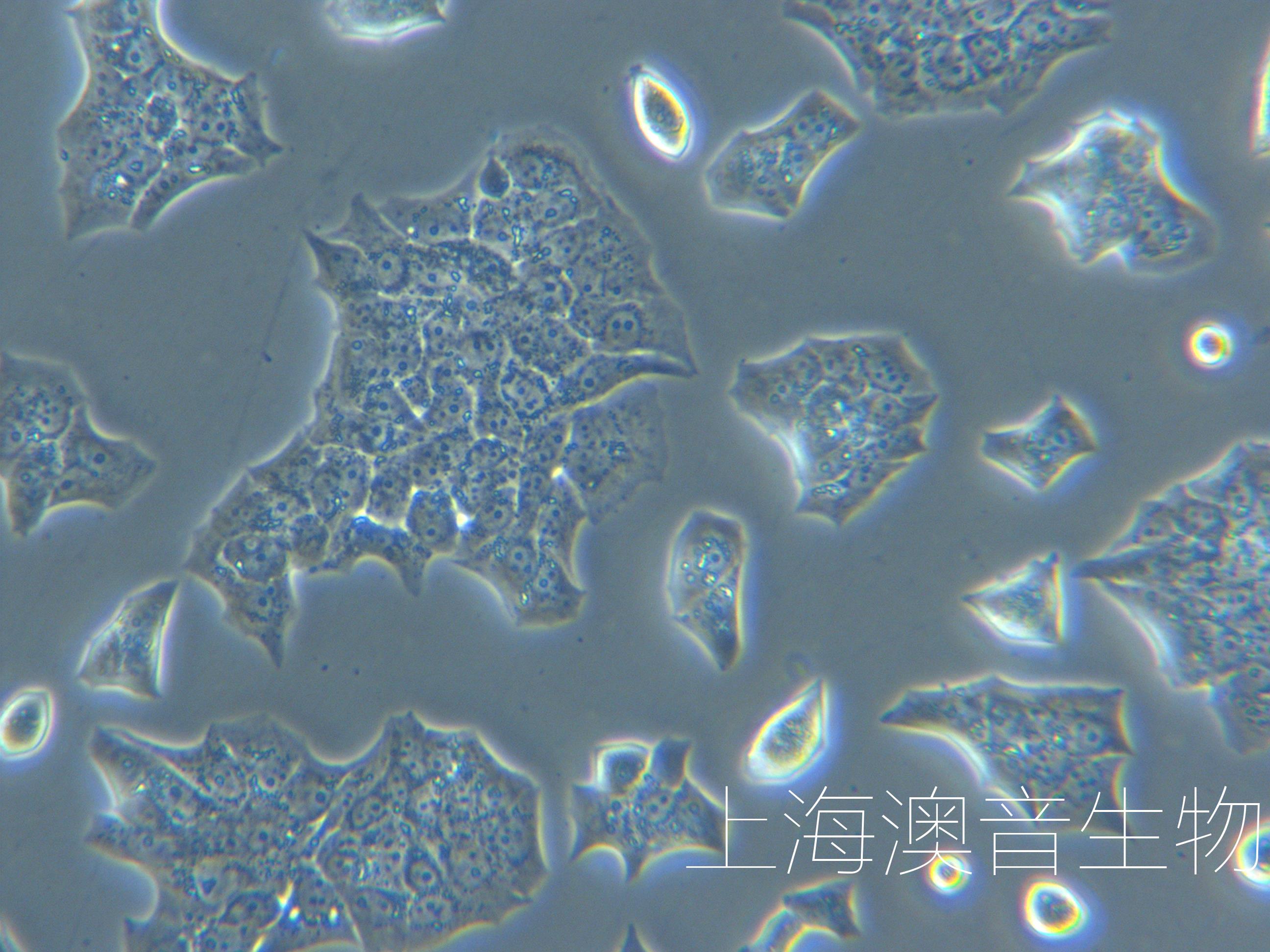 BT-474人乳腺导管癌细胞-企业官网