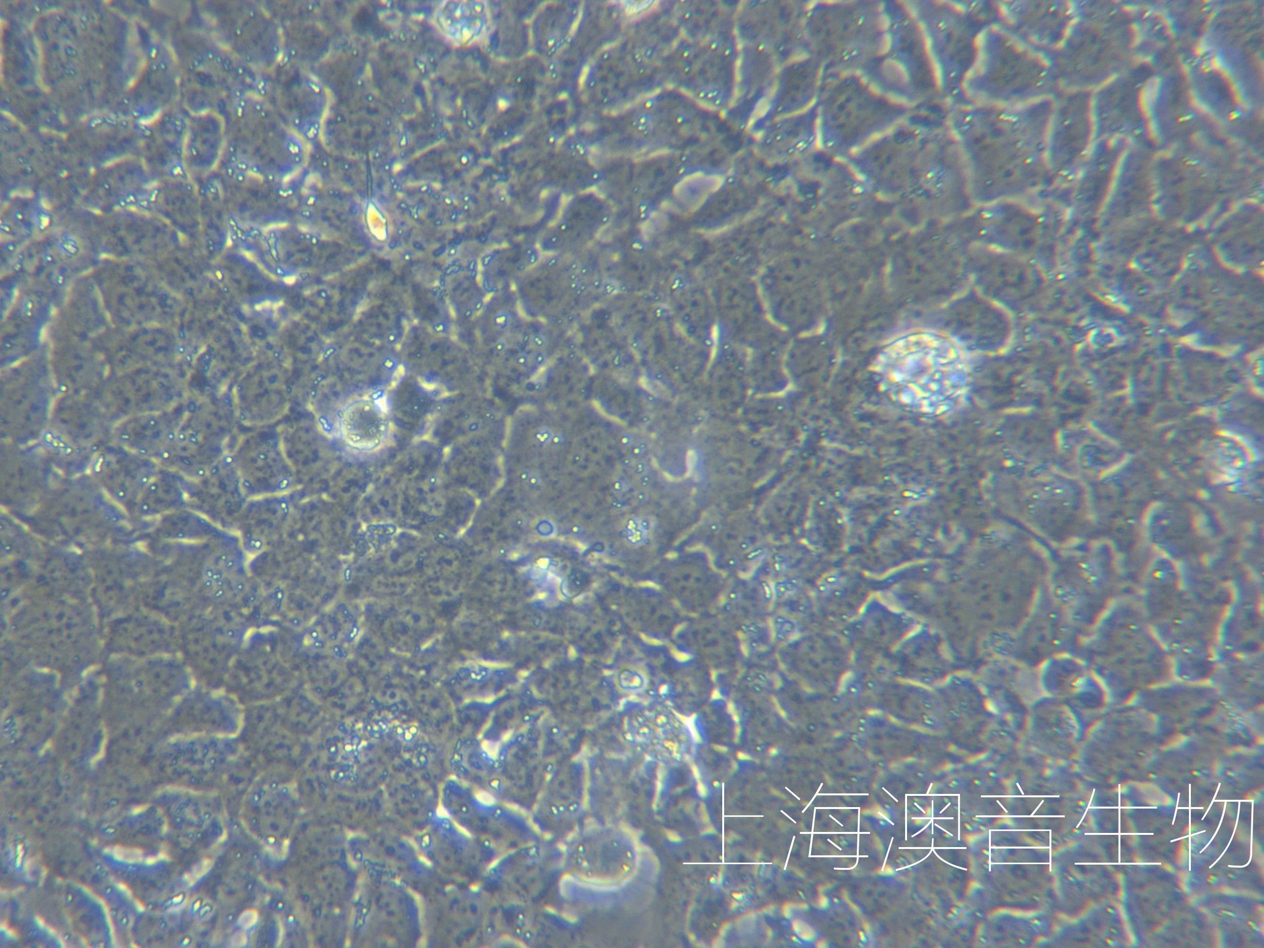 Hep 3B2.1-7-LUC萤火虫荧光素酶标记的人肝癌细胞-企业官网