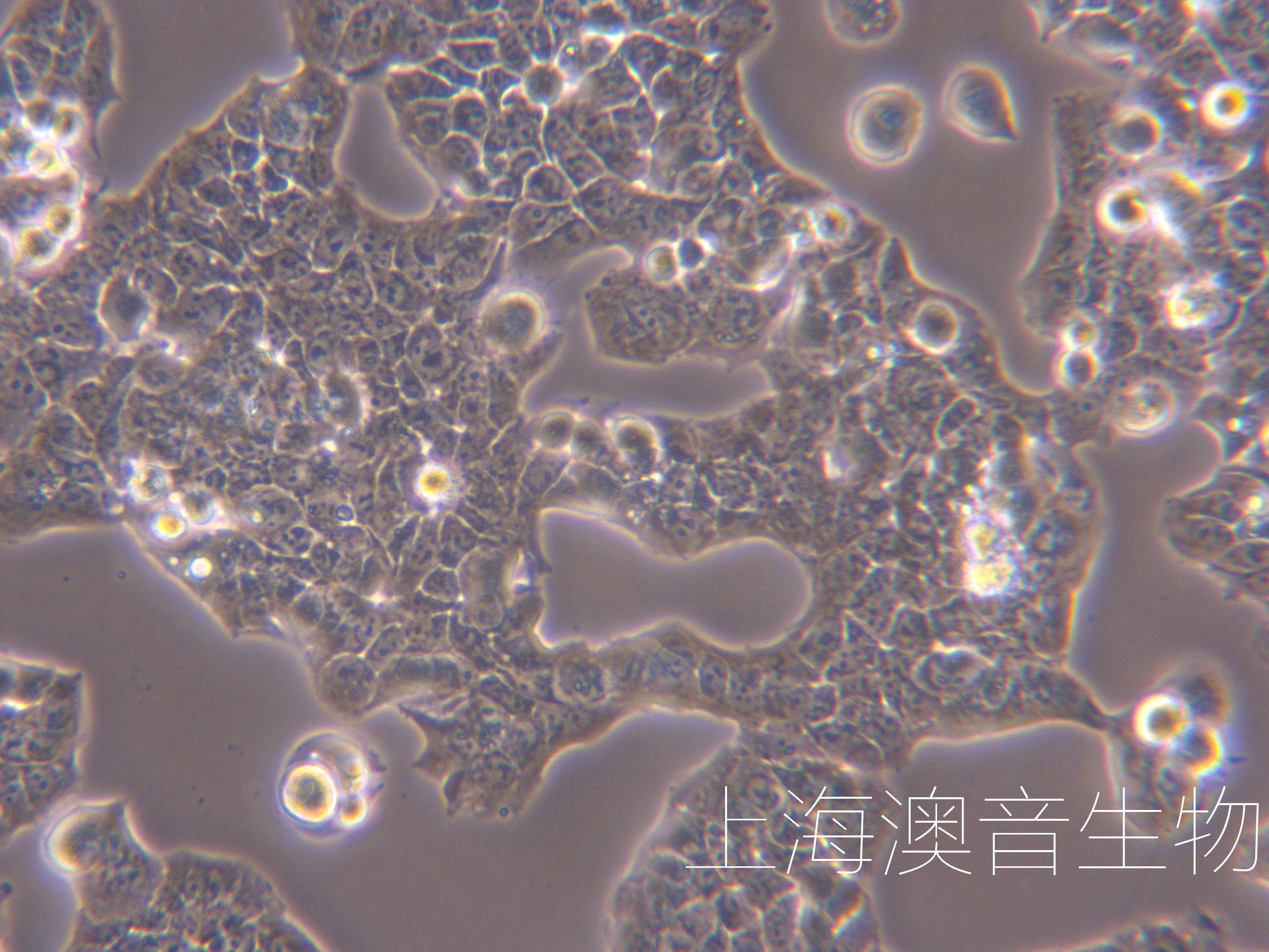 HEC-1-A人子宫内膜腺癌细胞-企业官网