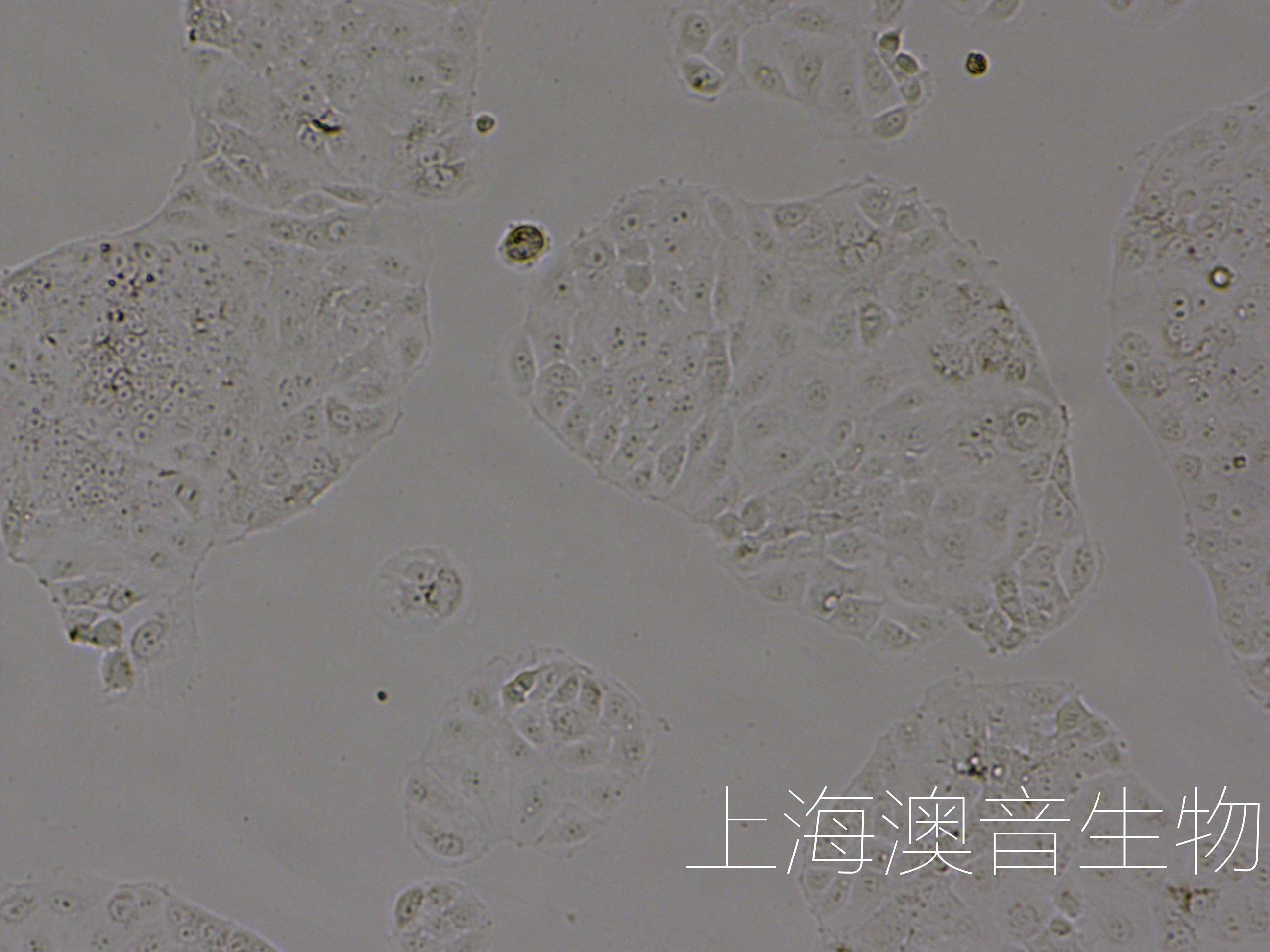 HUH-6人肝母细胞瘤细胞-企业官网
