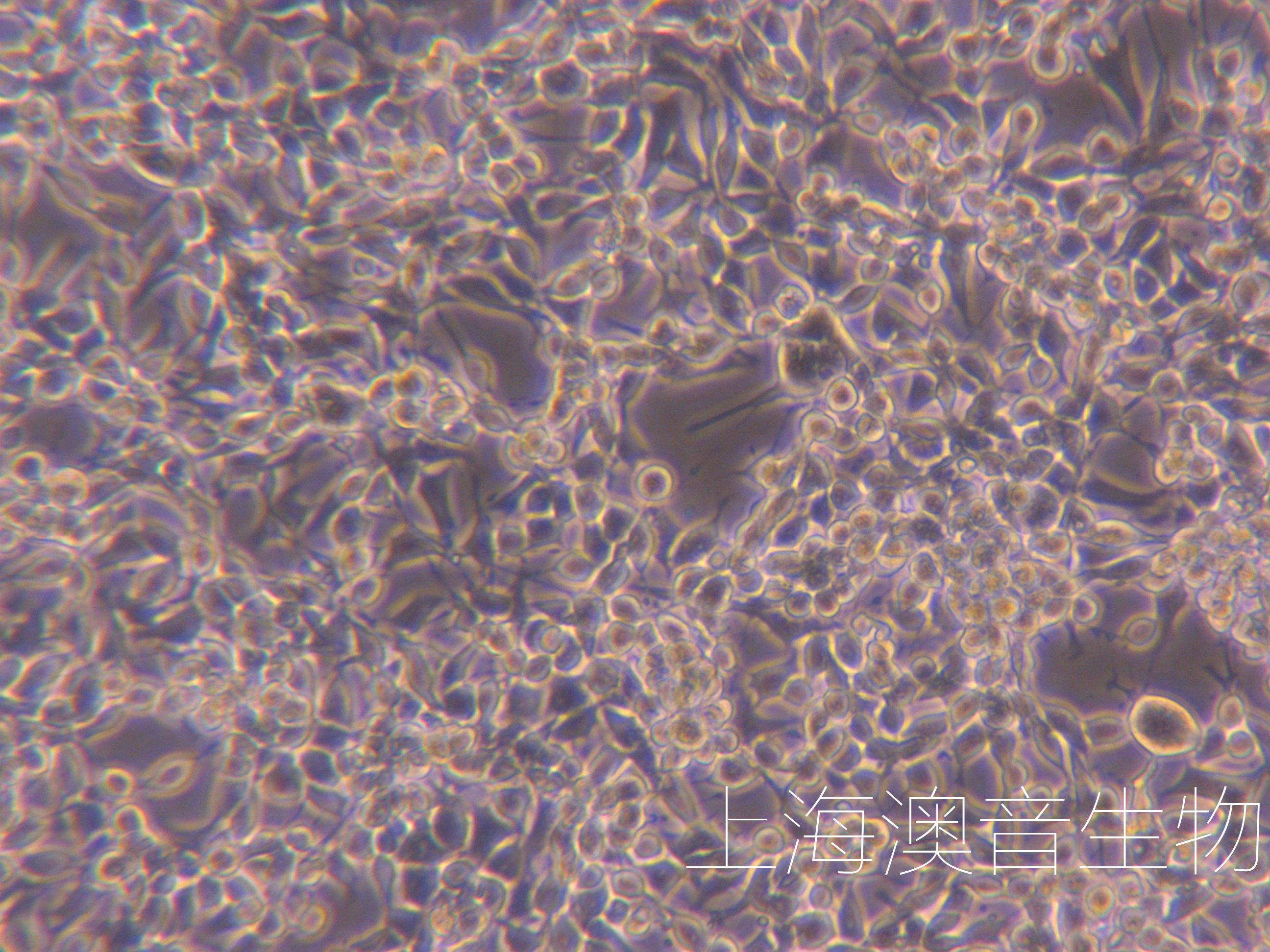 Mc38小鼠结肠癌细胞 企业官网