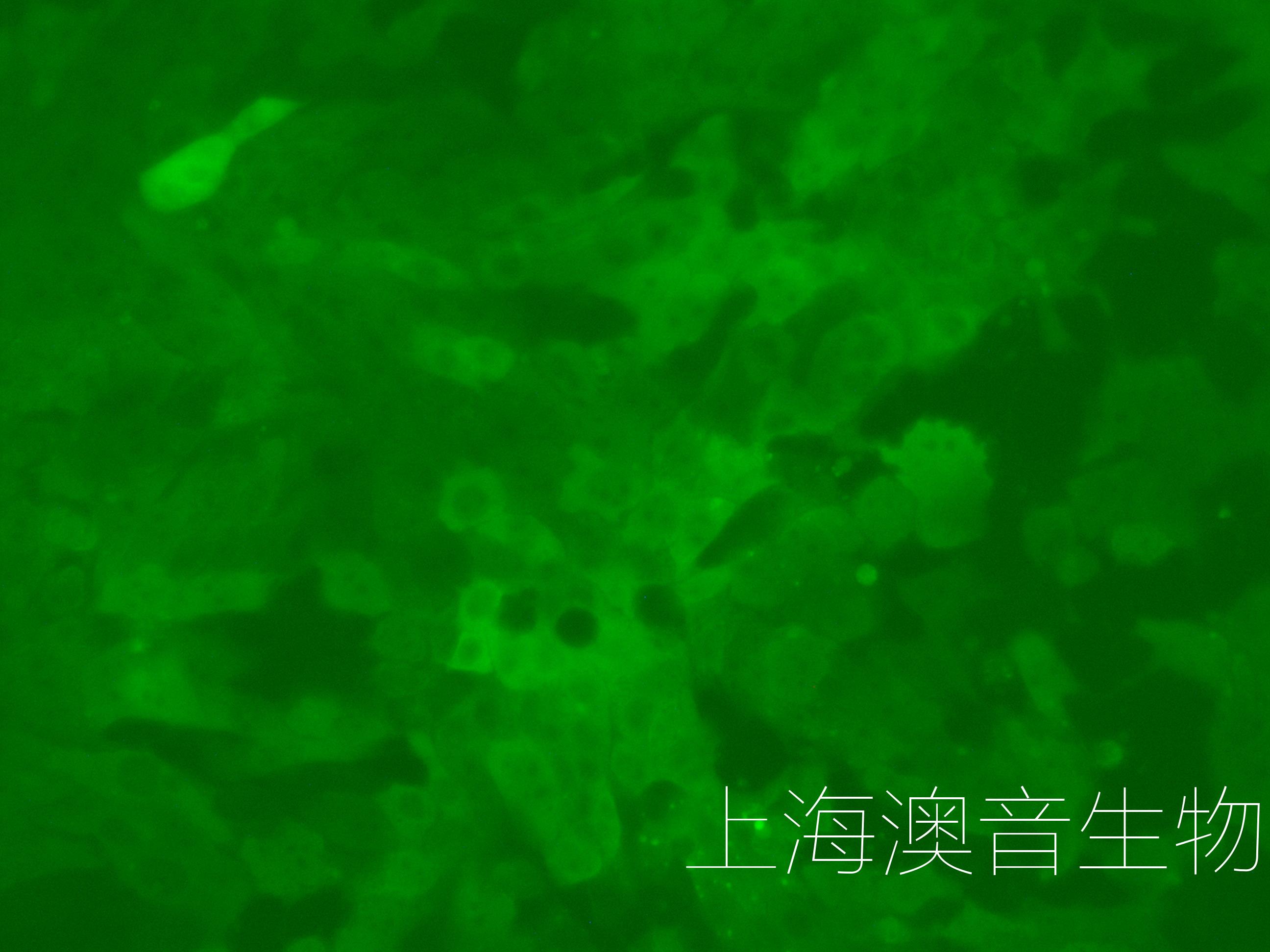 4T1-LUC-GFP-Puro双标记的小鼠乳腺癌细胞-企业官网