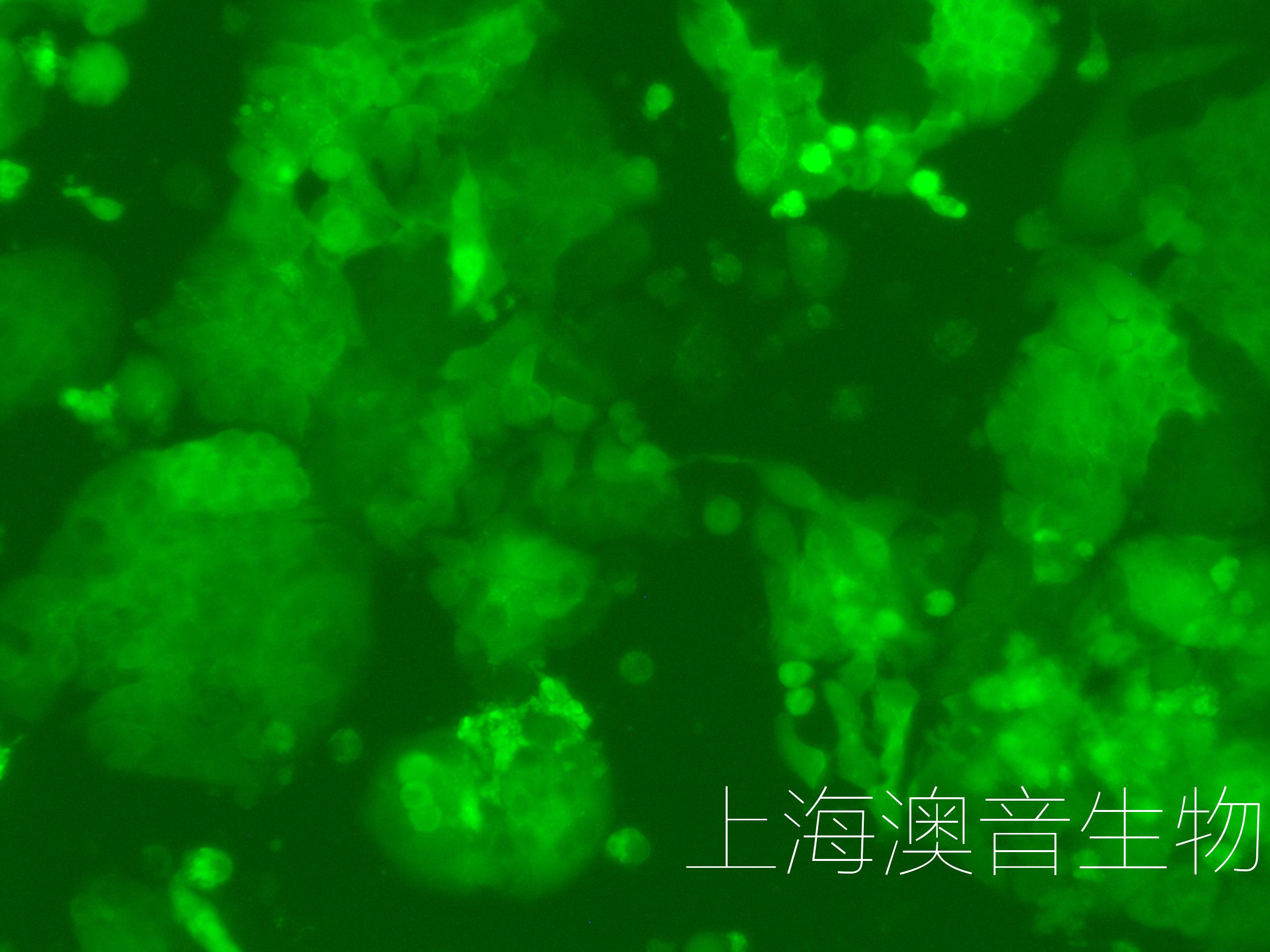 HT-29-LUC-GFP-Puro双标记的人结肠癌细胞-企业官网