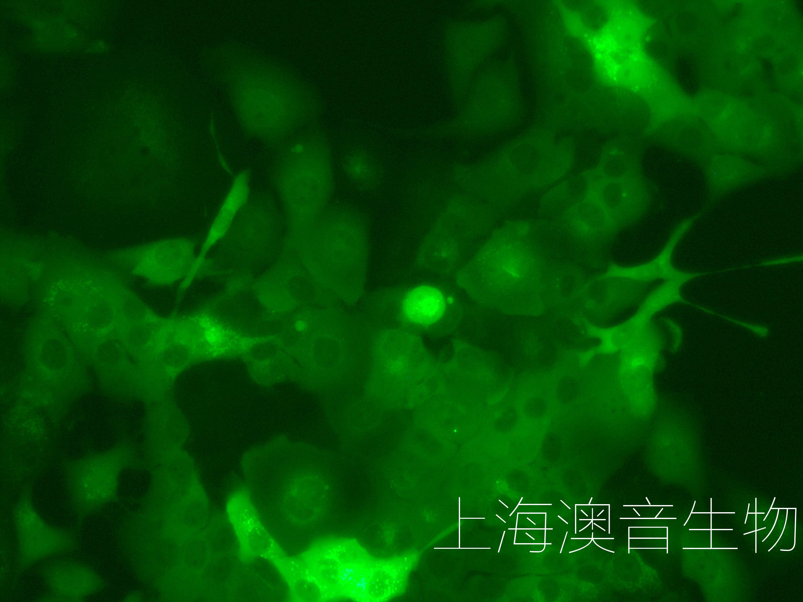 HCC827-LUC-GFP-Puro双标记的人非小细胞肺癌细胞-企业官网