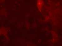 HCC827-LUC-RFP-Puro双标记的人非小细胞肺癌细胞-企业官网