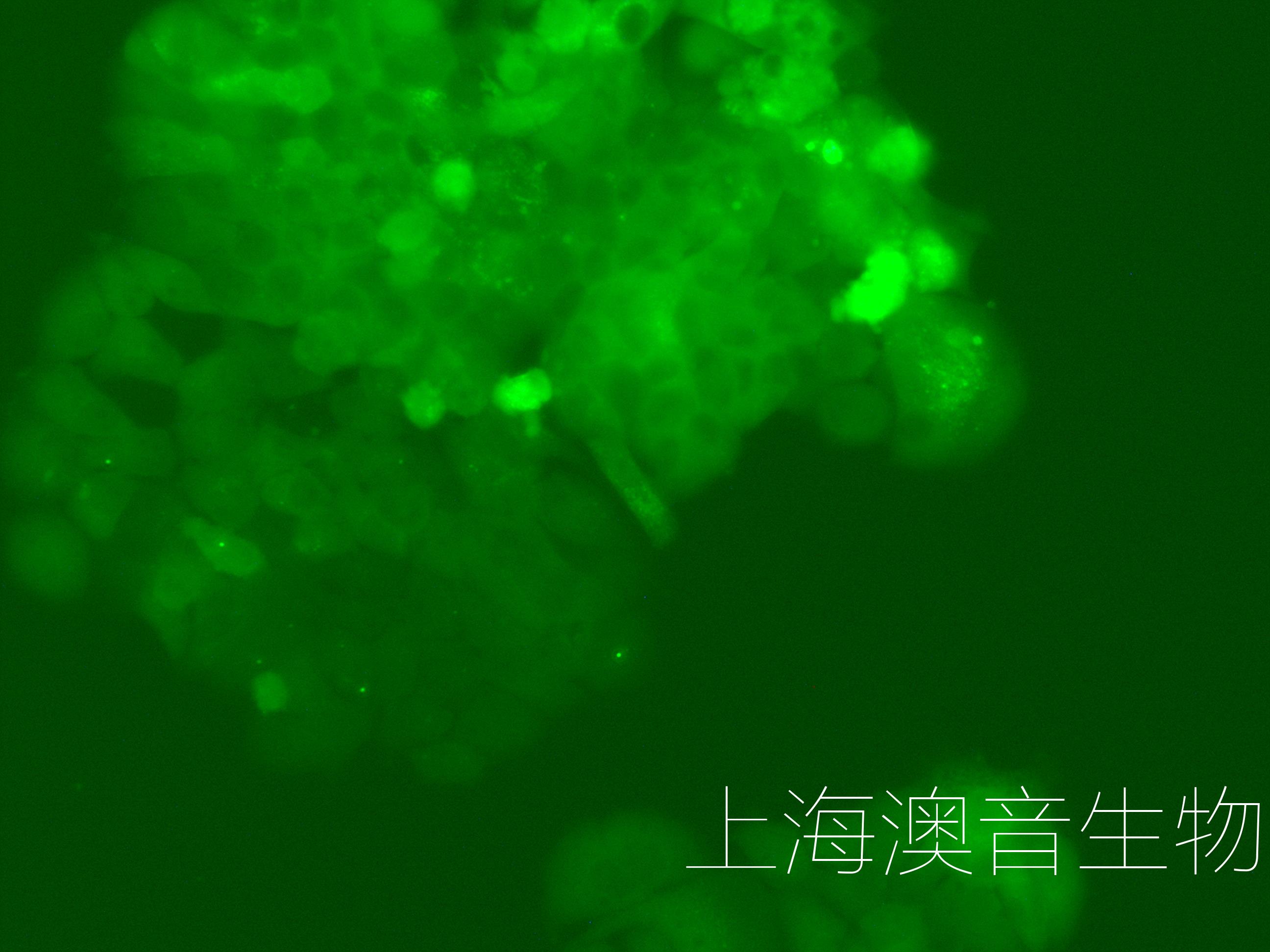 MCF-7-LUC-GFP-Puro双标记的人乳腺癌细胞-企业官网