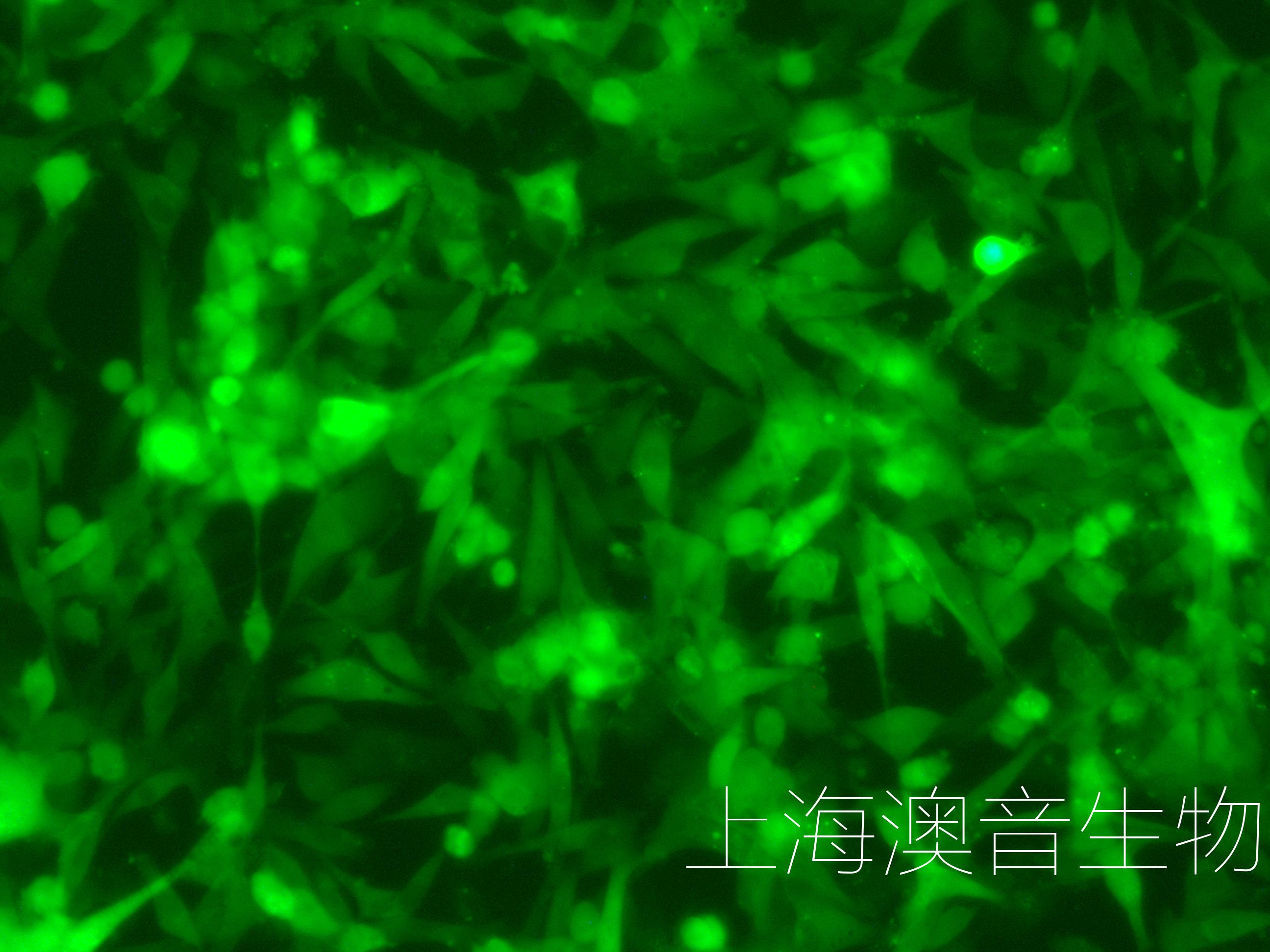 U-87MG-LUC-GFP-Puro双标记的人脑星形胶质母细胞瘤-企业官网