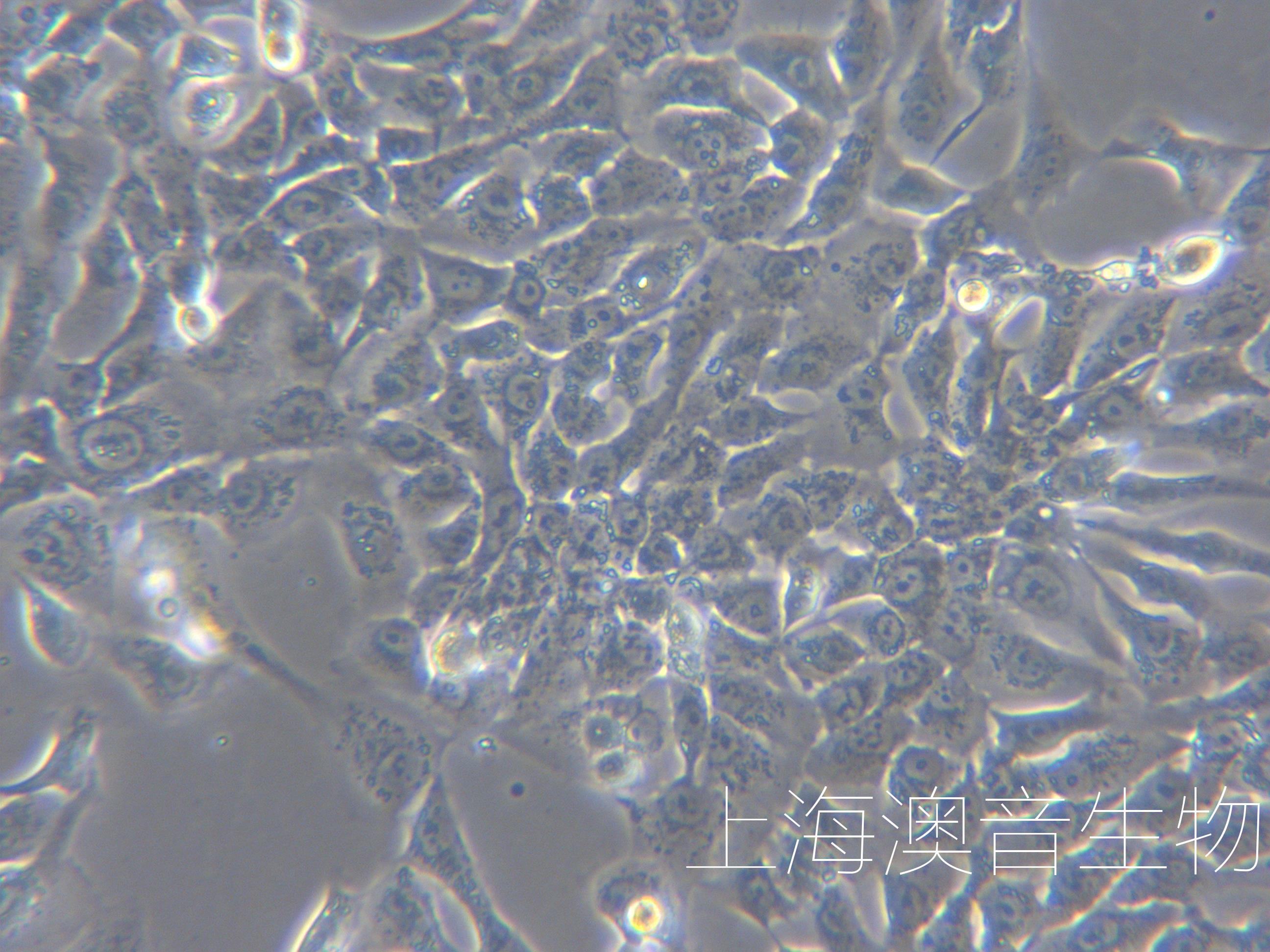 NCI-H2009人肺腺癌细胞-企业官网