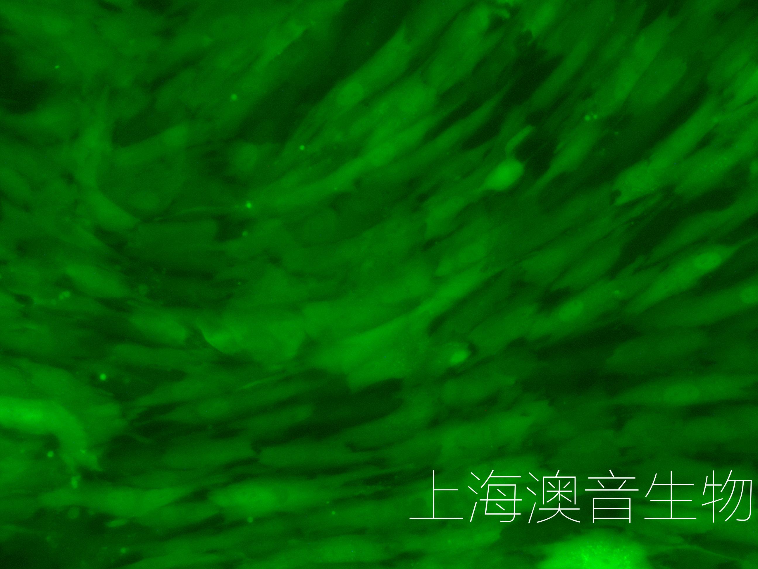 HMSC-ad-GFP绿色荧光蛋白标记的人脂肪干细胞-企业官网