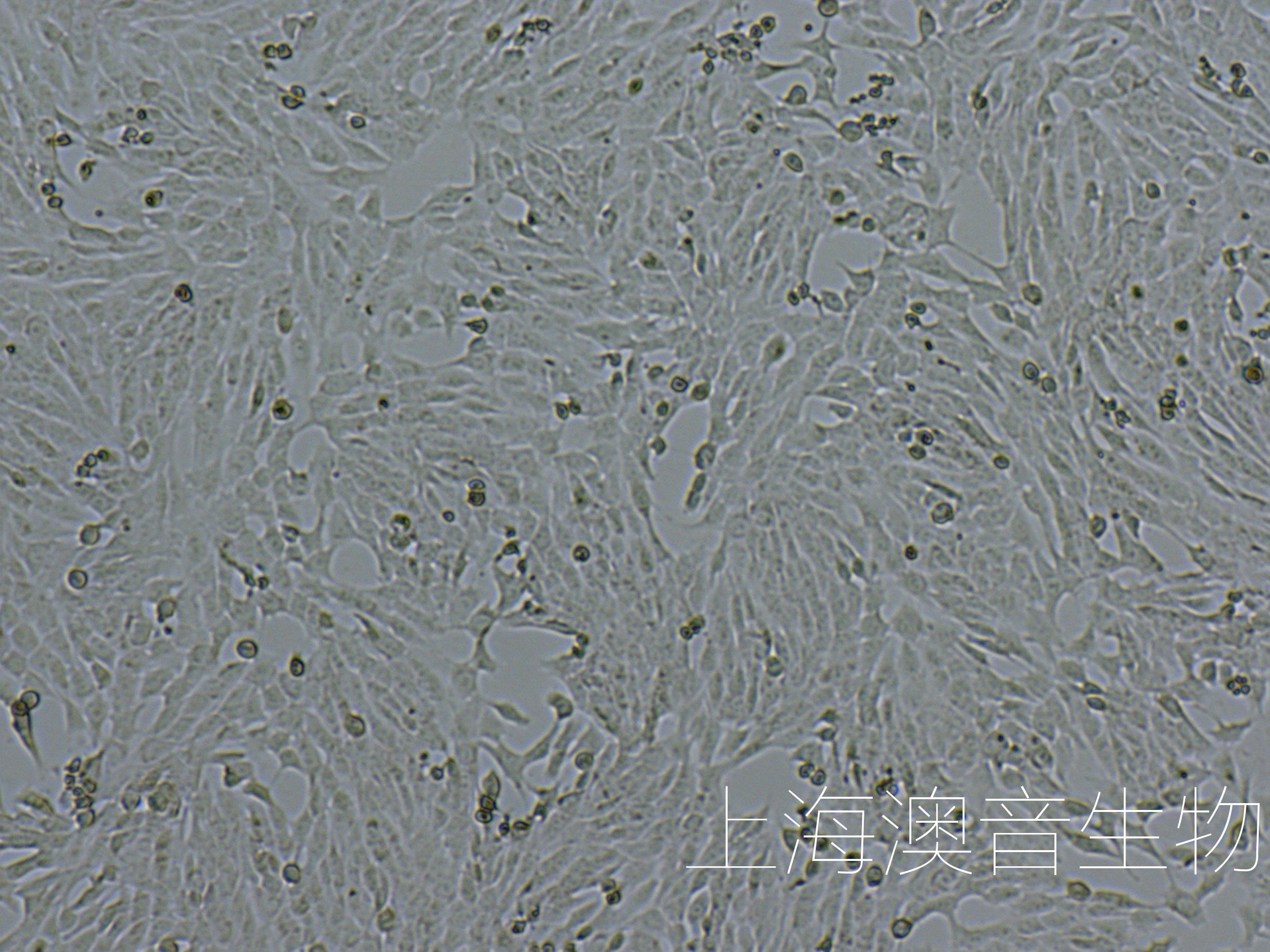 NIH:OVCAR-8人卵巢癌细胞-企业官网
