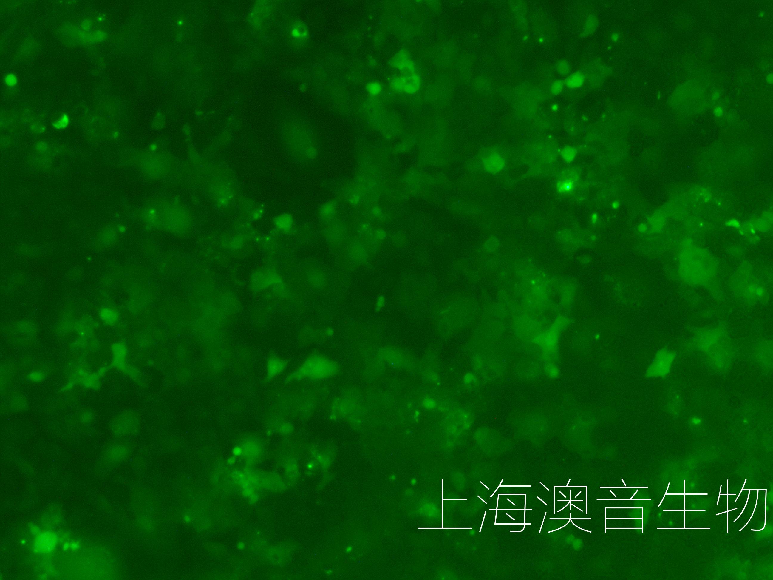 HuH-7-GFP 绿色荧光蛋白标记的人肝癌细胞-企业官网