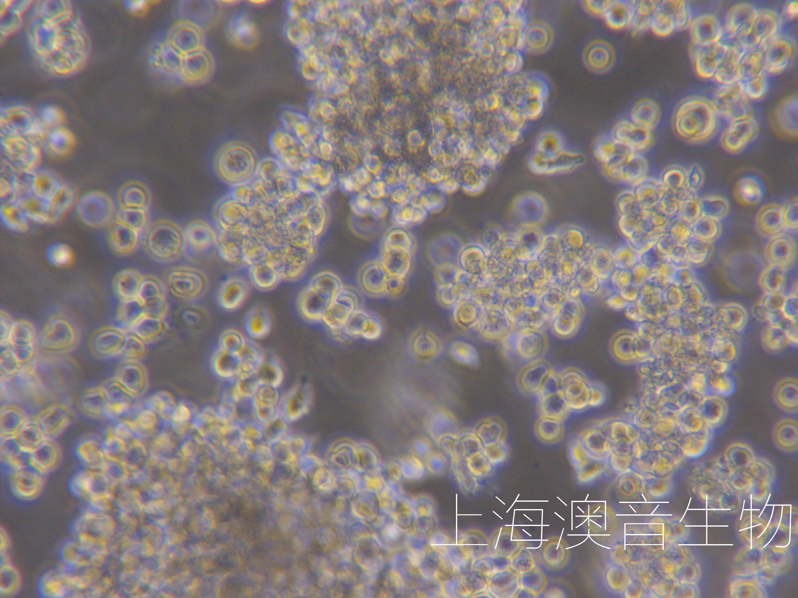 NK-92 [NK92]人恶性非霍奇金淋巴瘤患者的自然杀伤细胞-企业官网