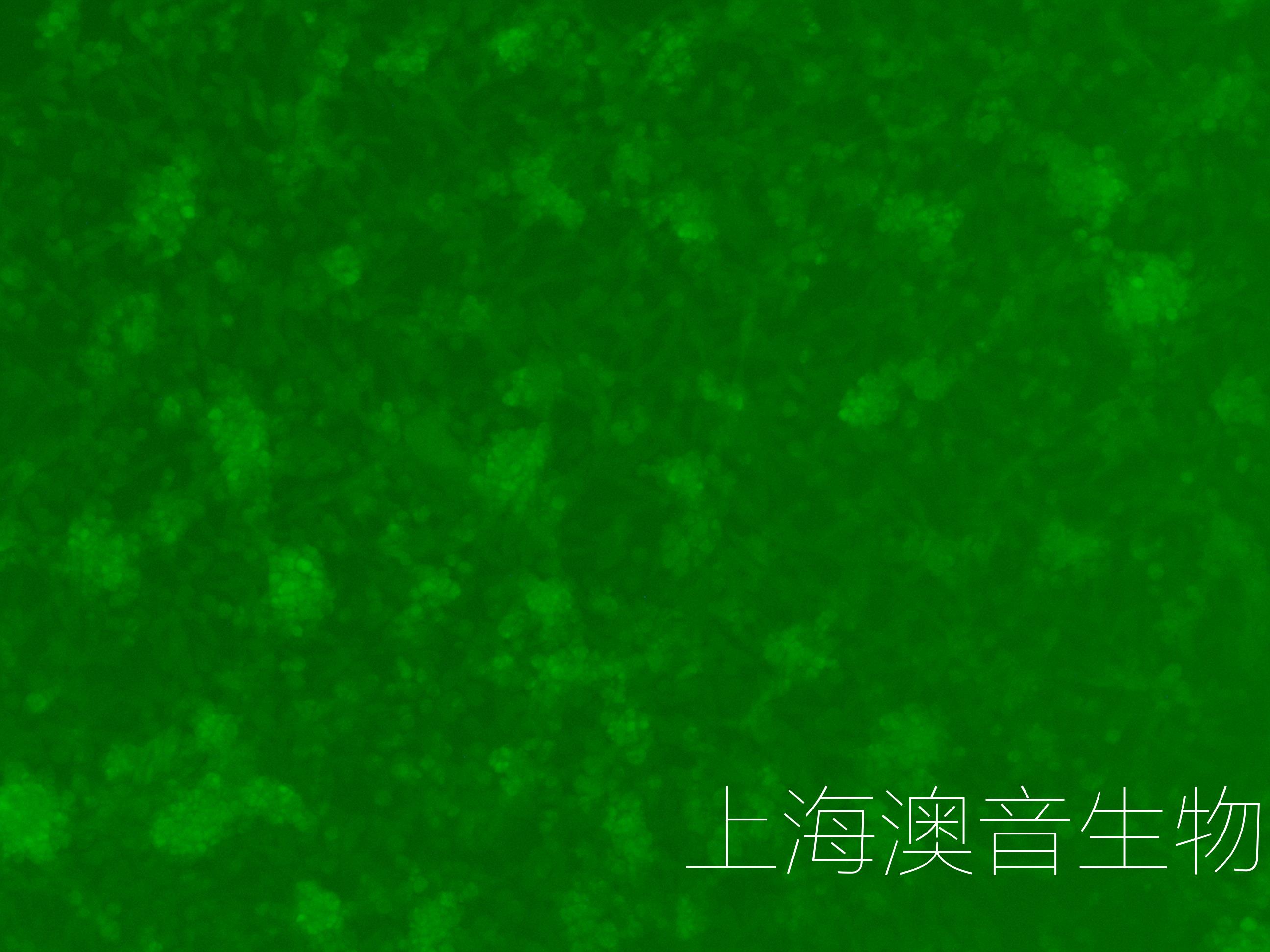 E0771-LUC-GFP-Puro双标记的小鼠髓样乳腺癌细胞-企业官网