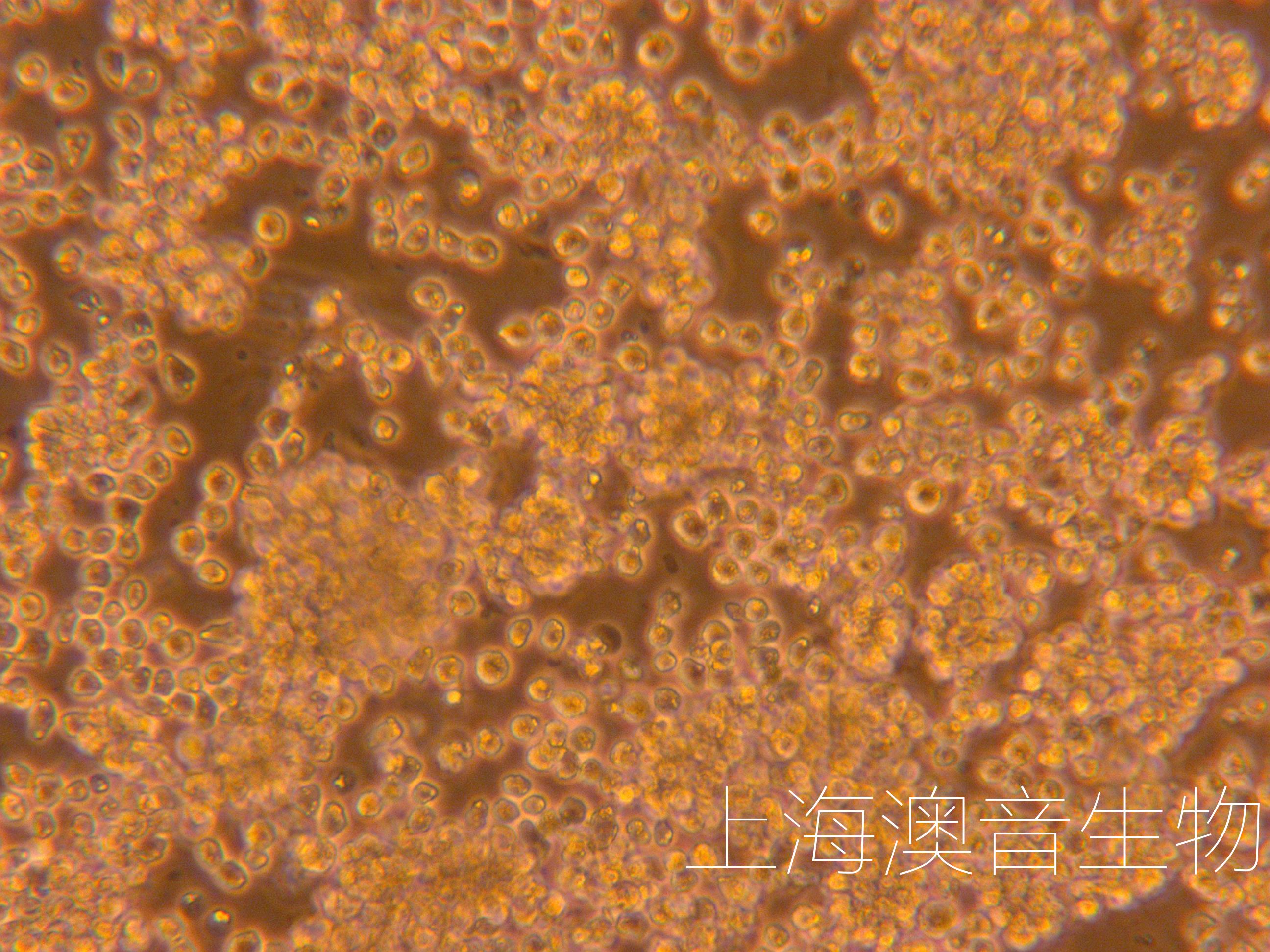 SUP-B15人Ph+急淋白血病细胞系-企业官网